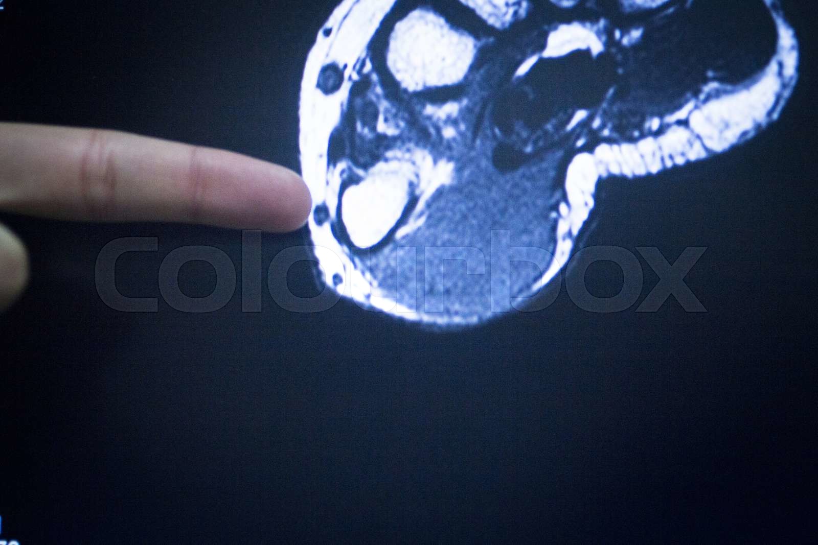 MRI magnetic resonance imaging foot toes scan | Stock image | Colourbox