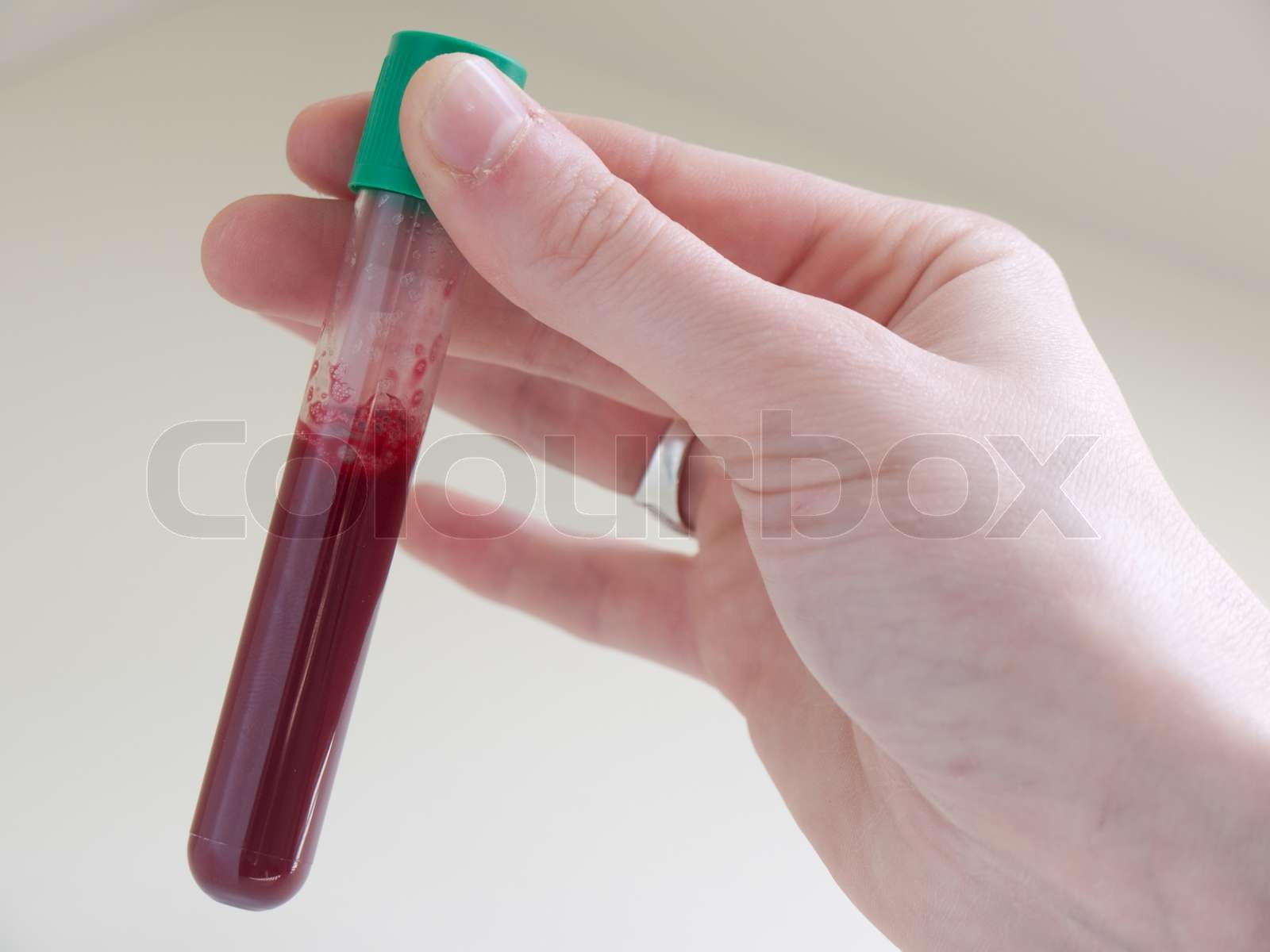 Blood indsamle rør fyldt med blod | Stock foto | Colourbox