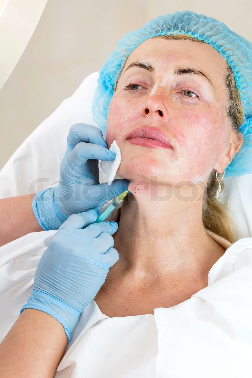 Cosmetic treatment with injection in a clinic | Stock image | Colourbox