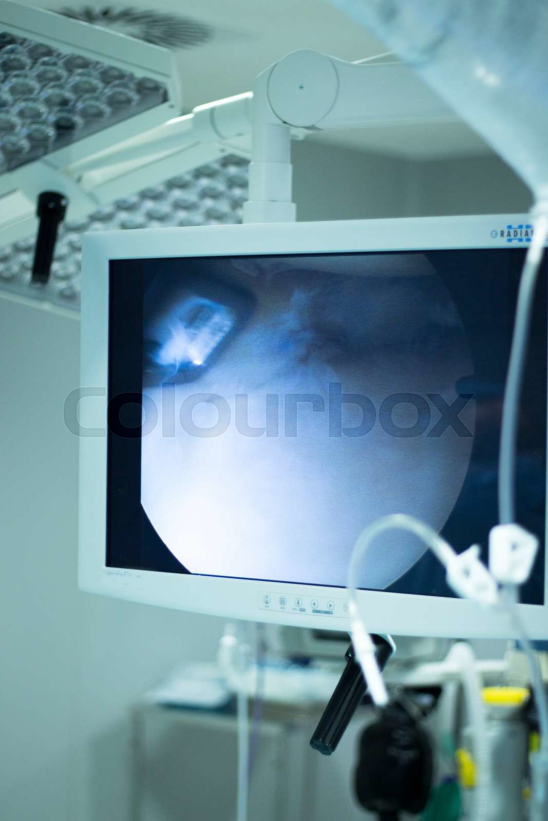 Hospital surgery arthroscopy operation screen | Stock image | Colourbox