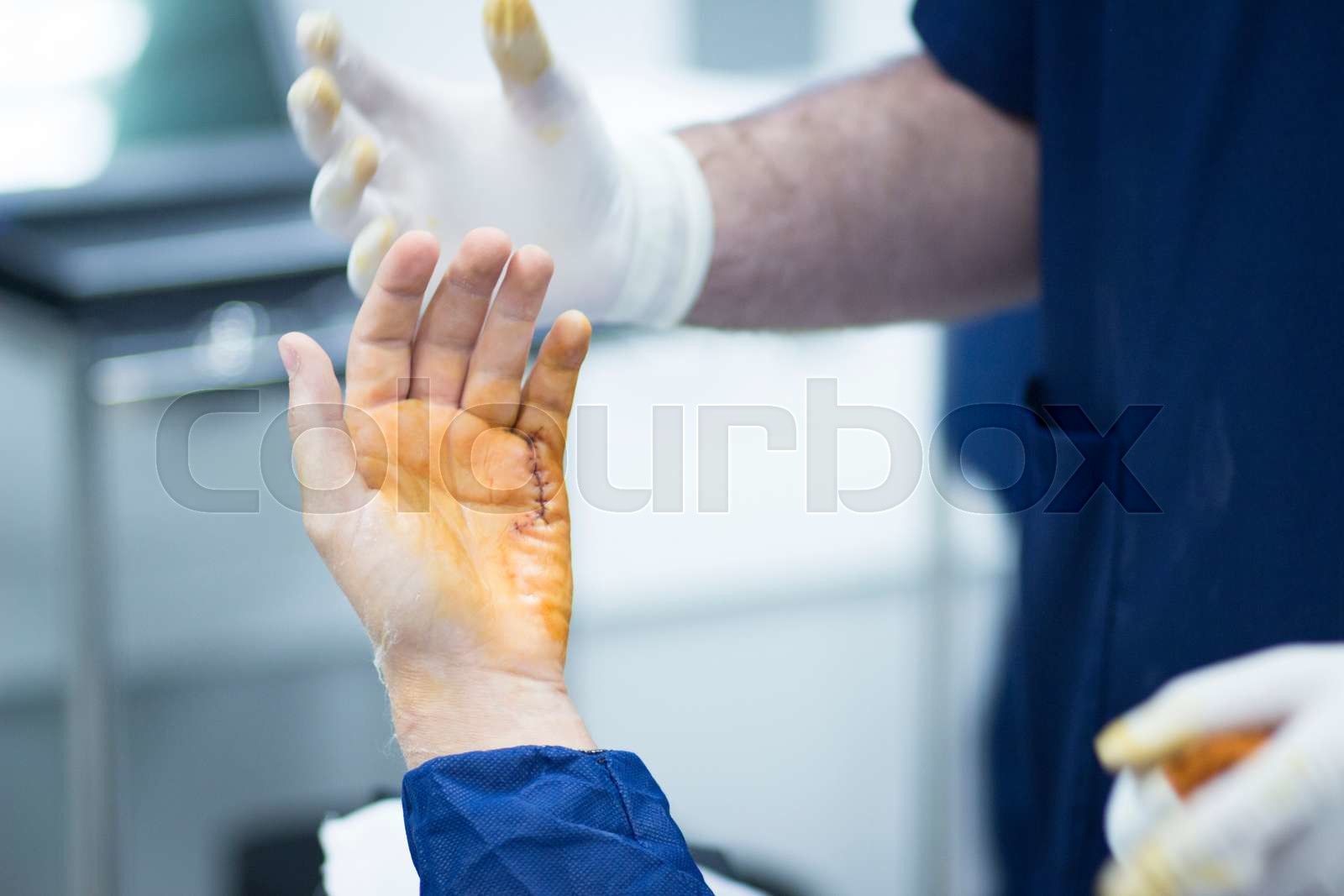 Hospital hand surgery orthopedics operation | Stock image | Colourbox