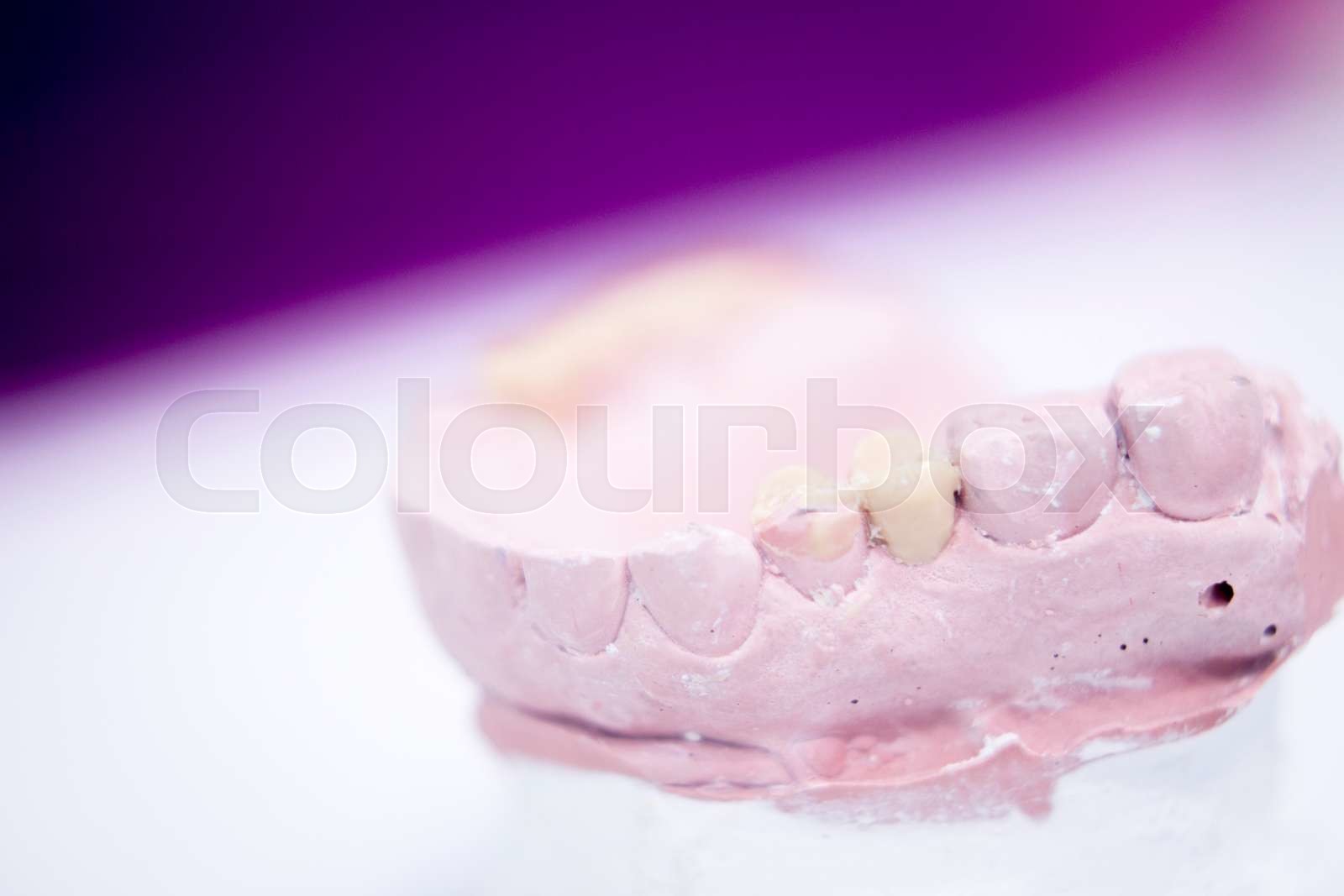 Dental prosthetics clay tooth mold | Stock image | Colourbox
