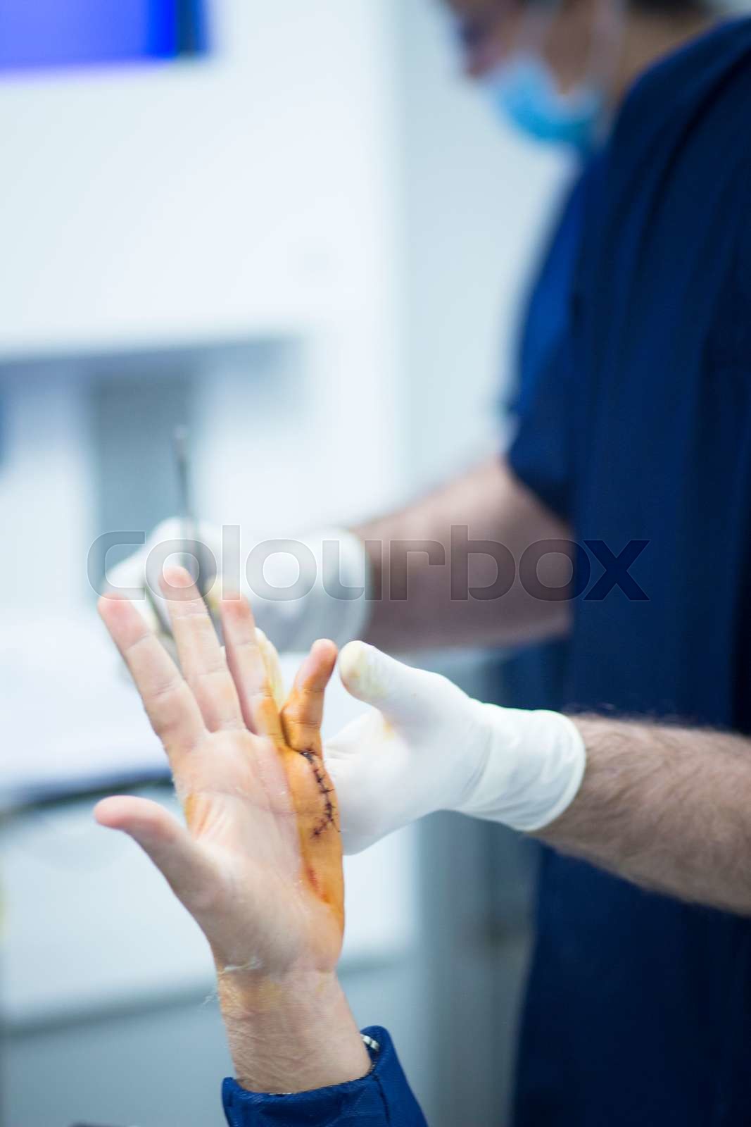 Hospital hand surgery orthopedics operation | Stock image | Colourbox