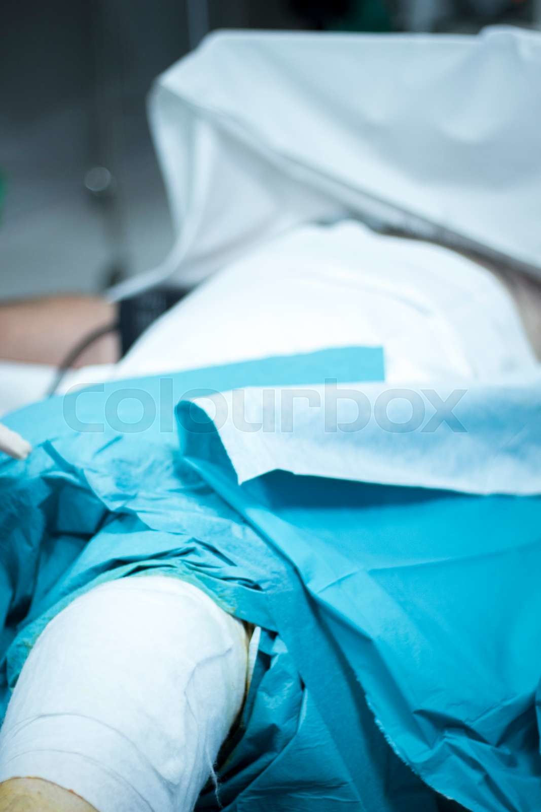 Knee arthroscopy orthopedic surgery operation | Stock image | Colourbox