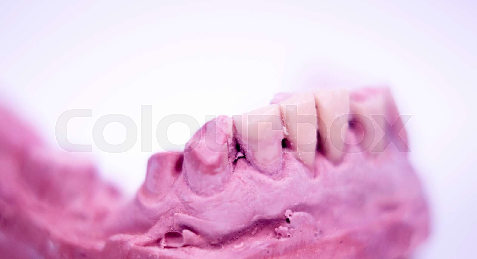 Dental prosthetics clay tooth mold | Stock image | Colourbox
