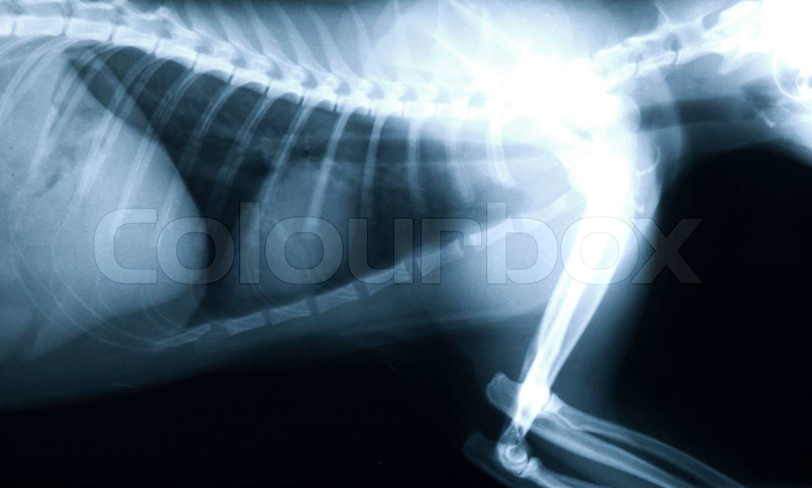 X-ray thorax | Stock image | Colourbox