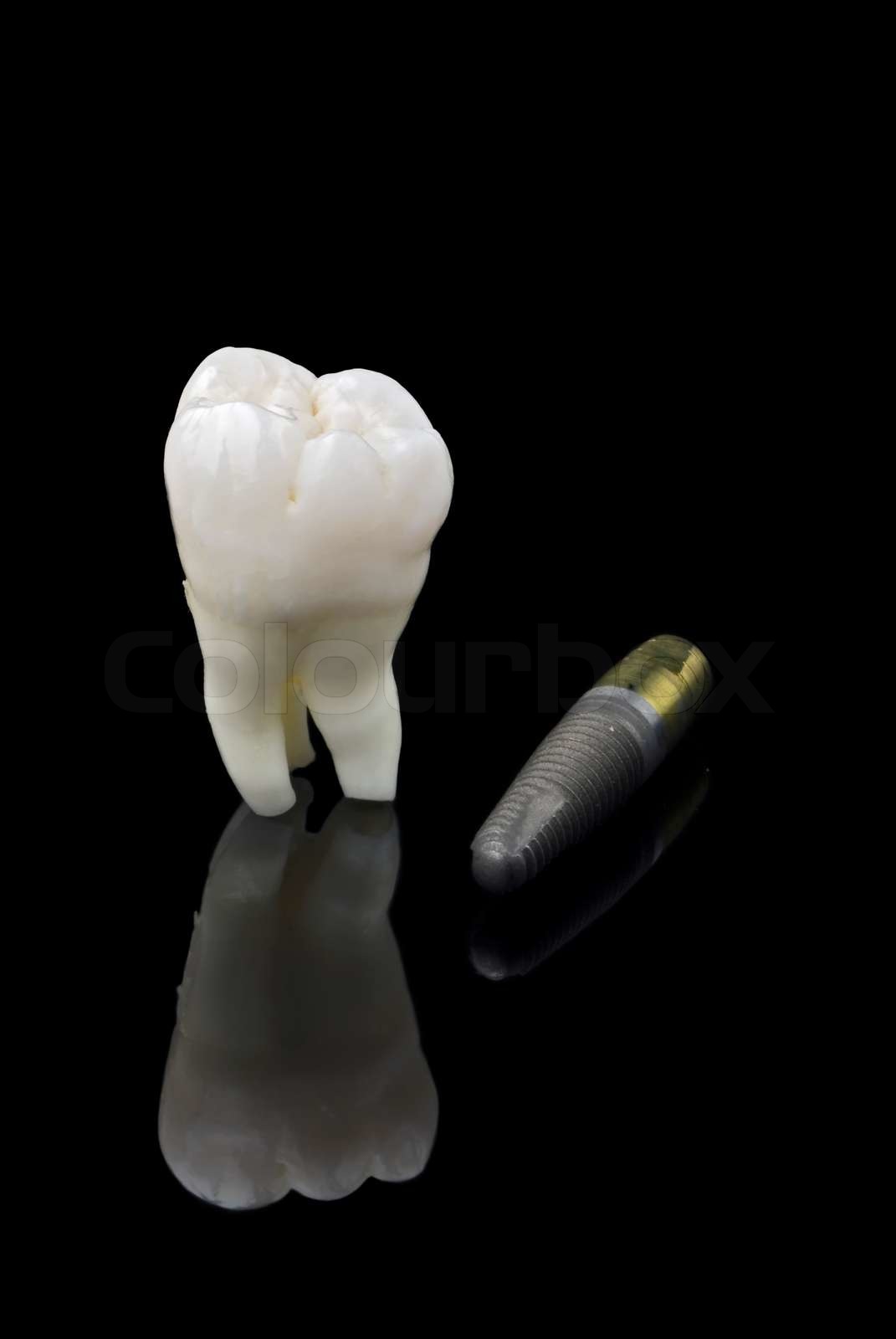 Human wisdom tooth and titanium implant over black | Stock image ...