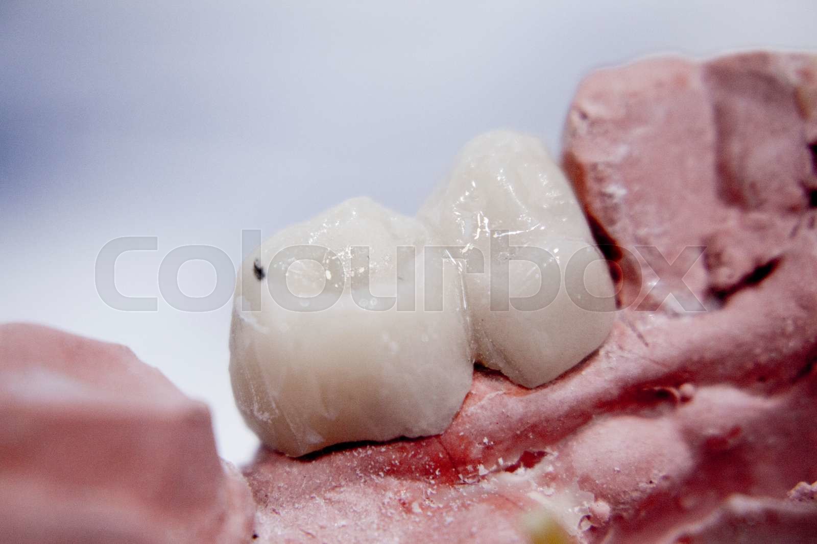 Dental prosthetics clay tooth mold | Stock image | Colourbox