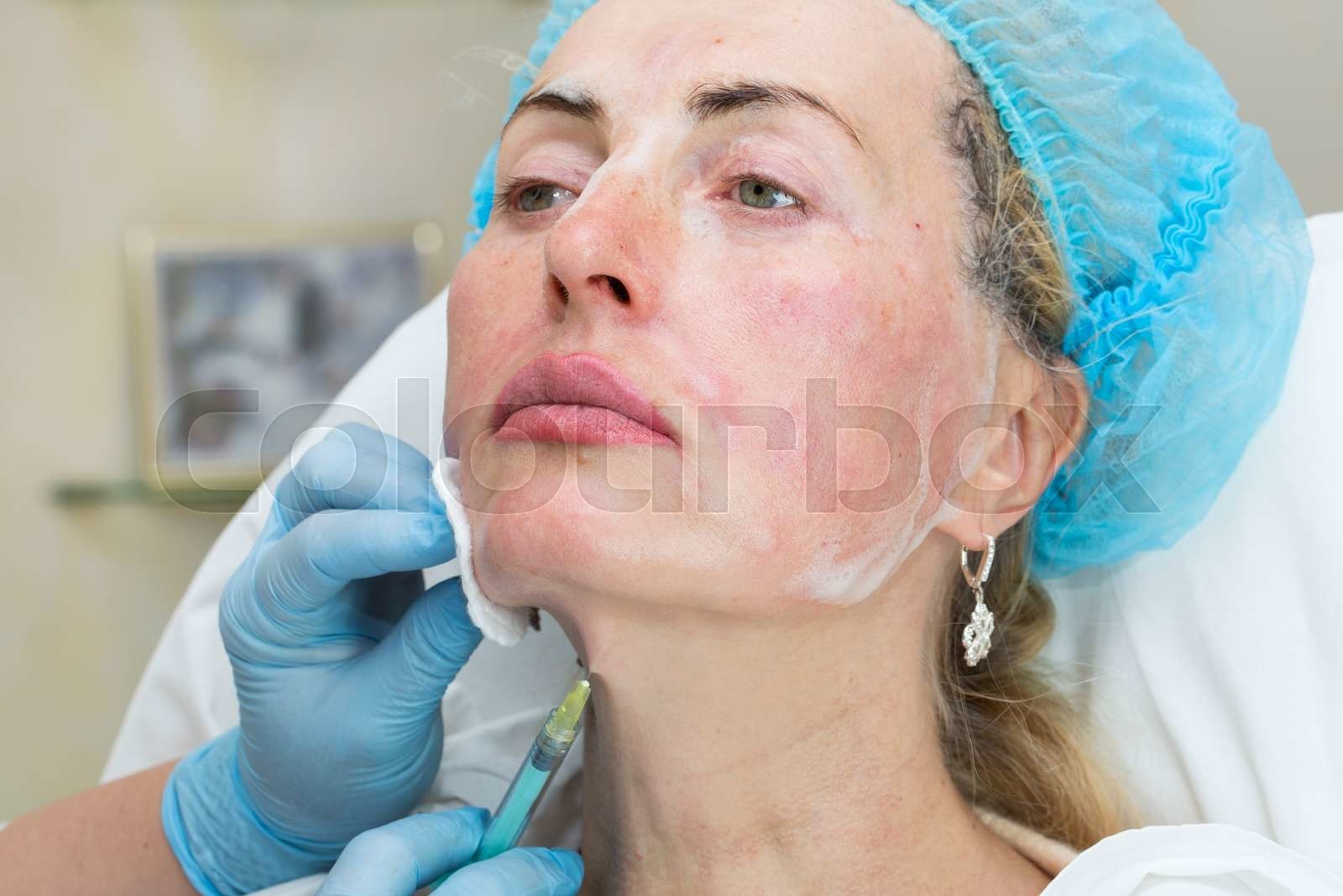 Cosmetic treatment with injection in a clinic | Stock image | Colourbox