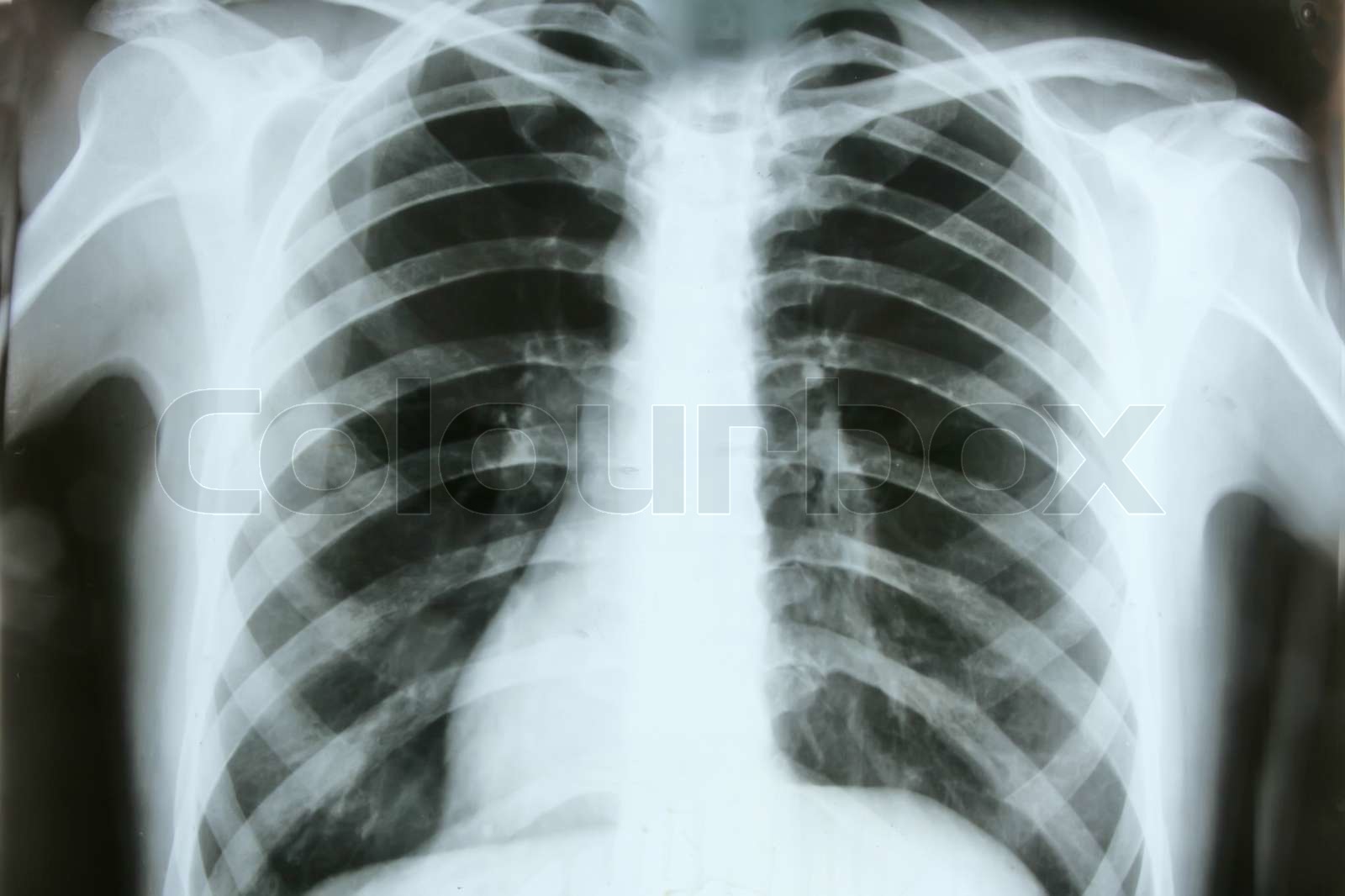 human skeleton xray | Stock image | Colourbox