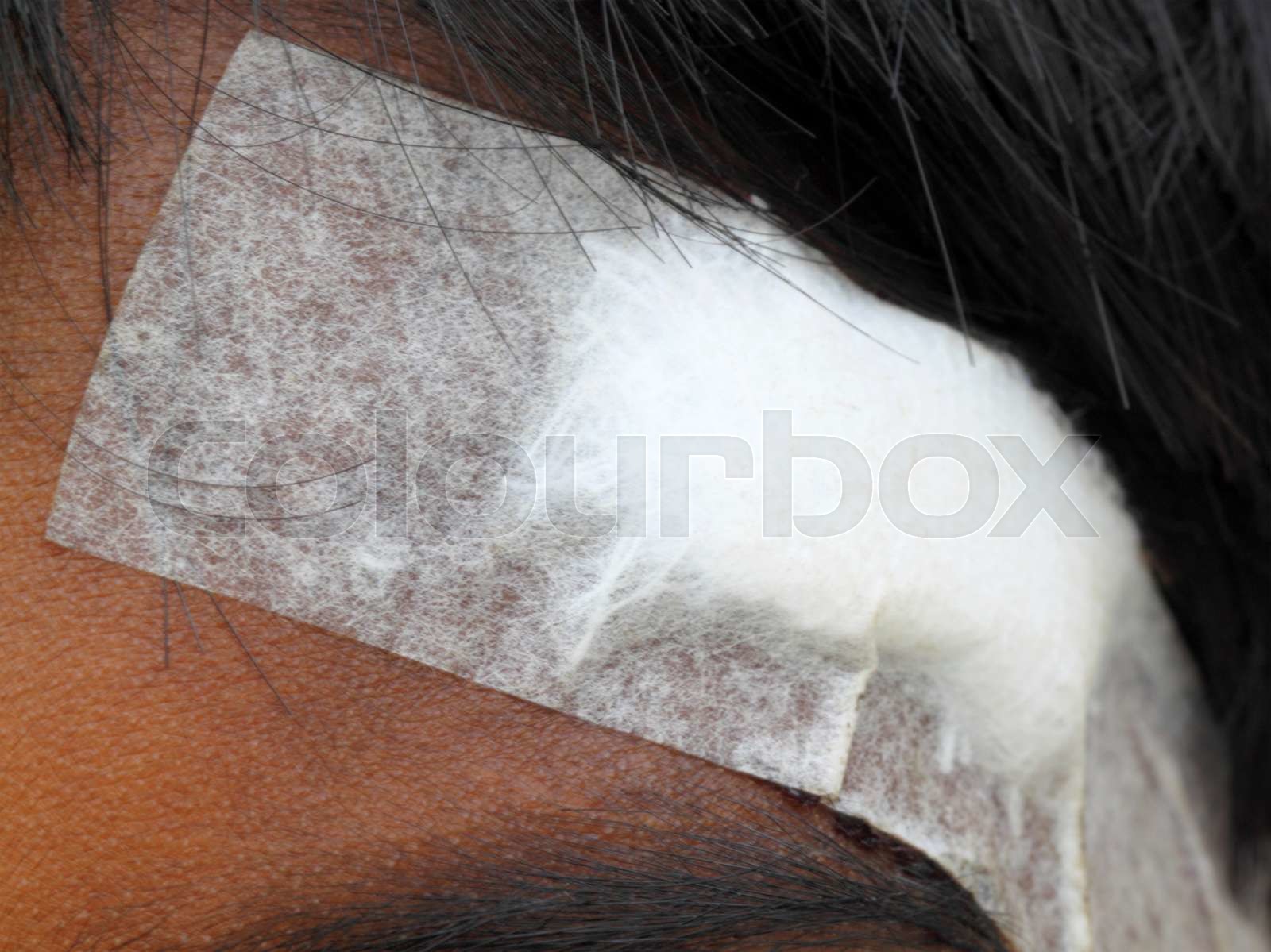 Forehead wound | Stock image | Colourbox