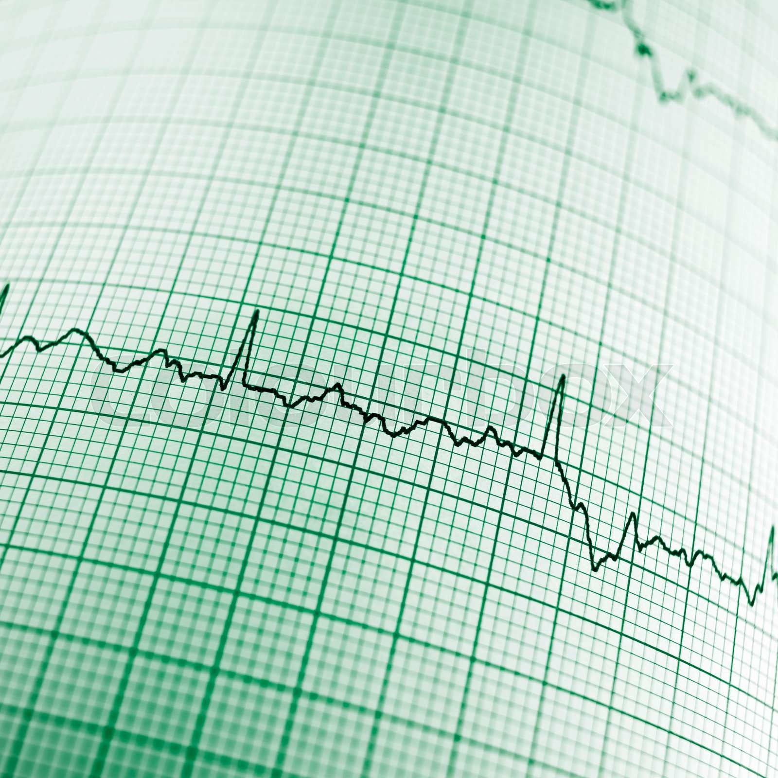 Electrocardiogram | Stock image | Colourbox