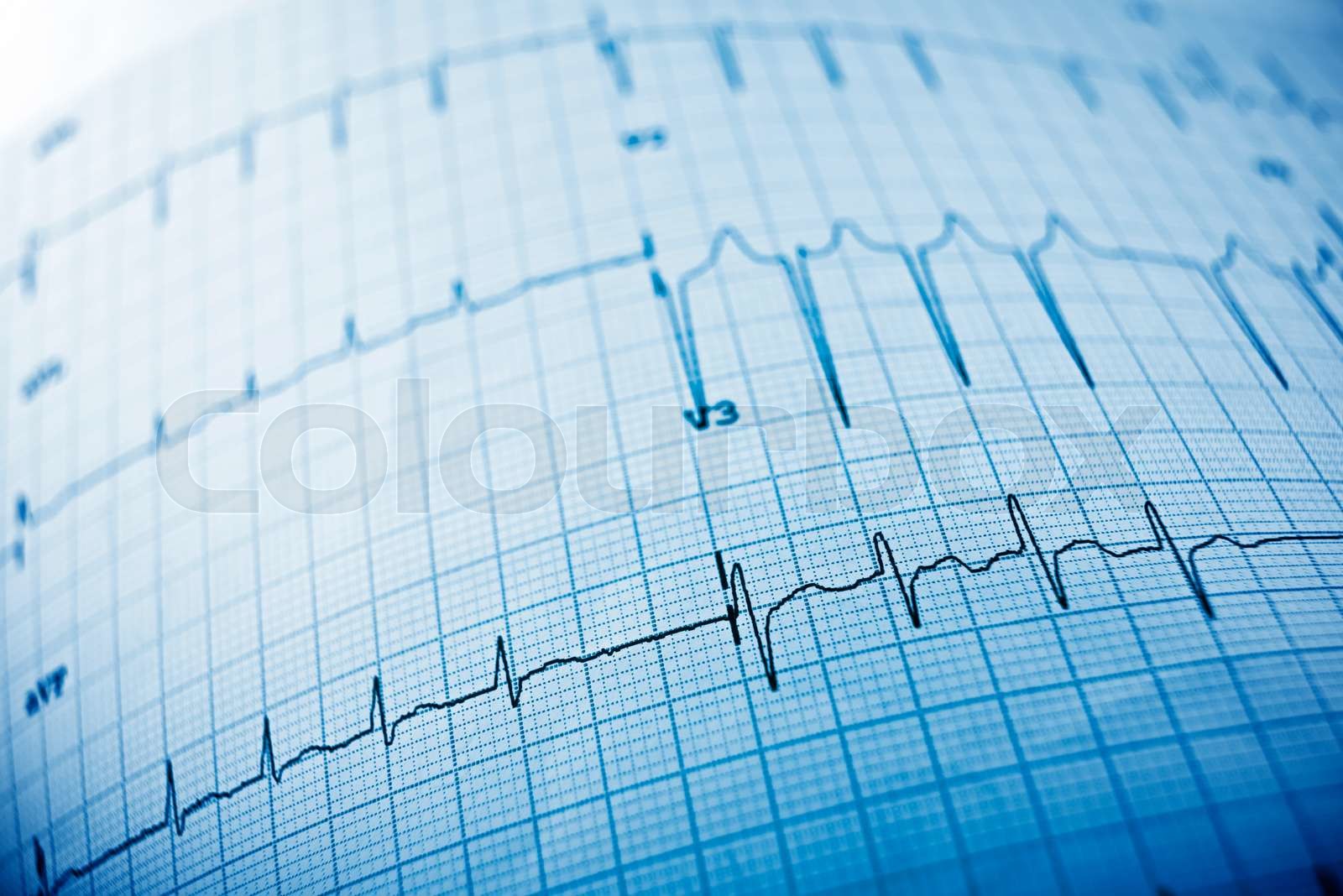Electrocardiogram | Stock image | Colourbox