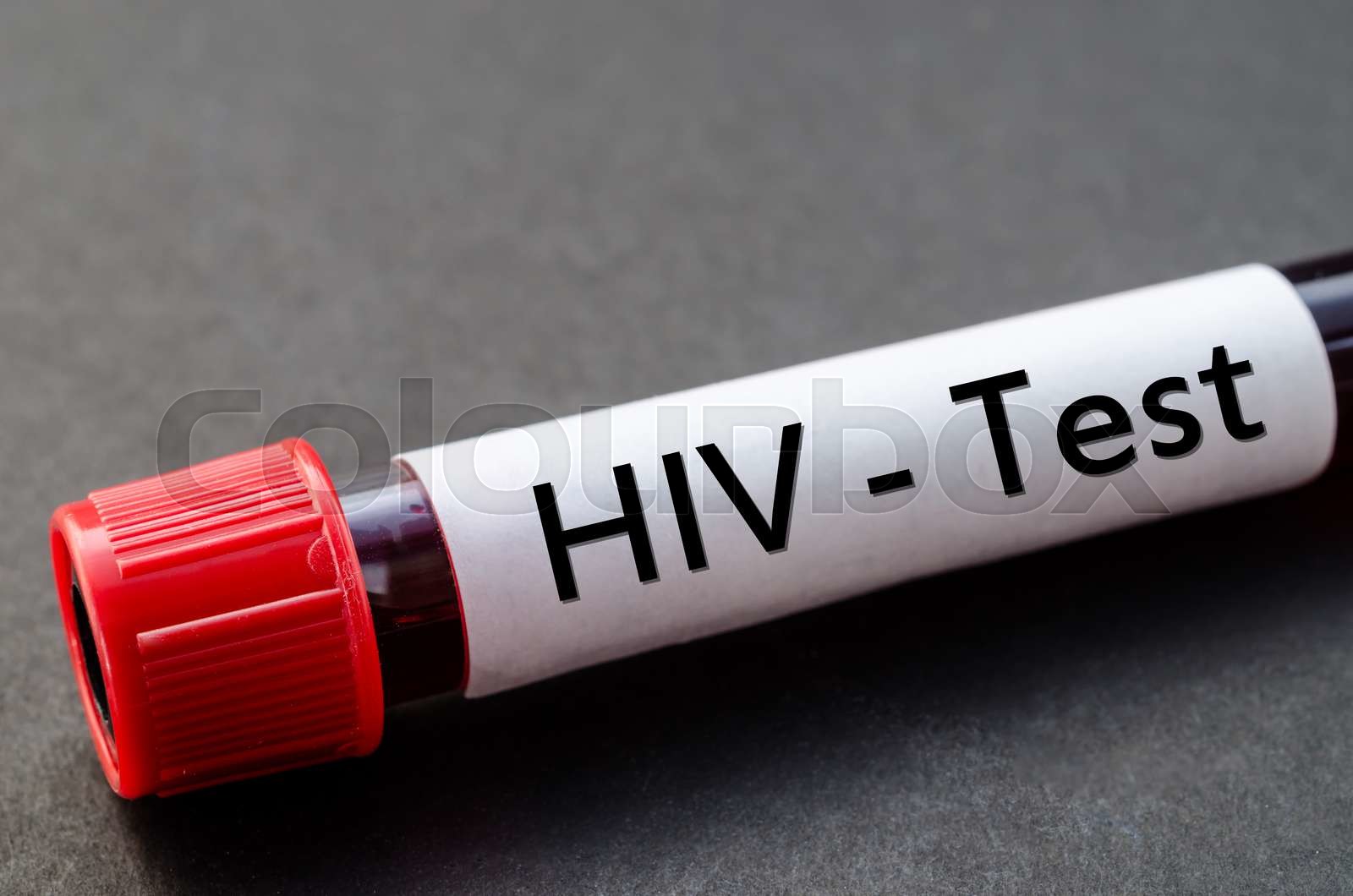 Sample blood collection tube with HIV test. | Stock image | Colourbox