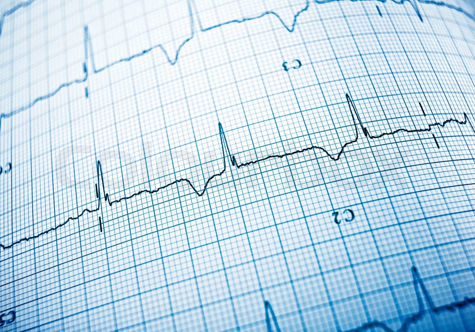 Electrocardiogram | Stock image | Colourbox