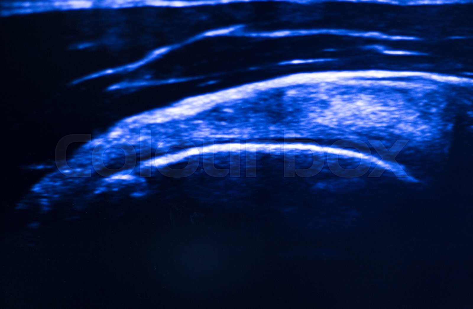 Ultrasound ecograph EPI ecography | Stock image | Colourbox