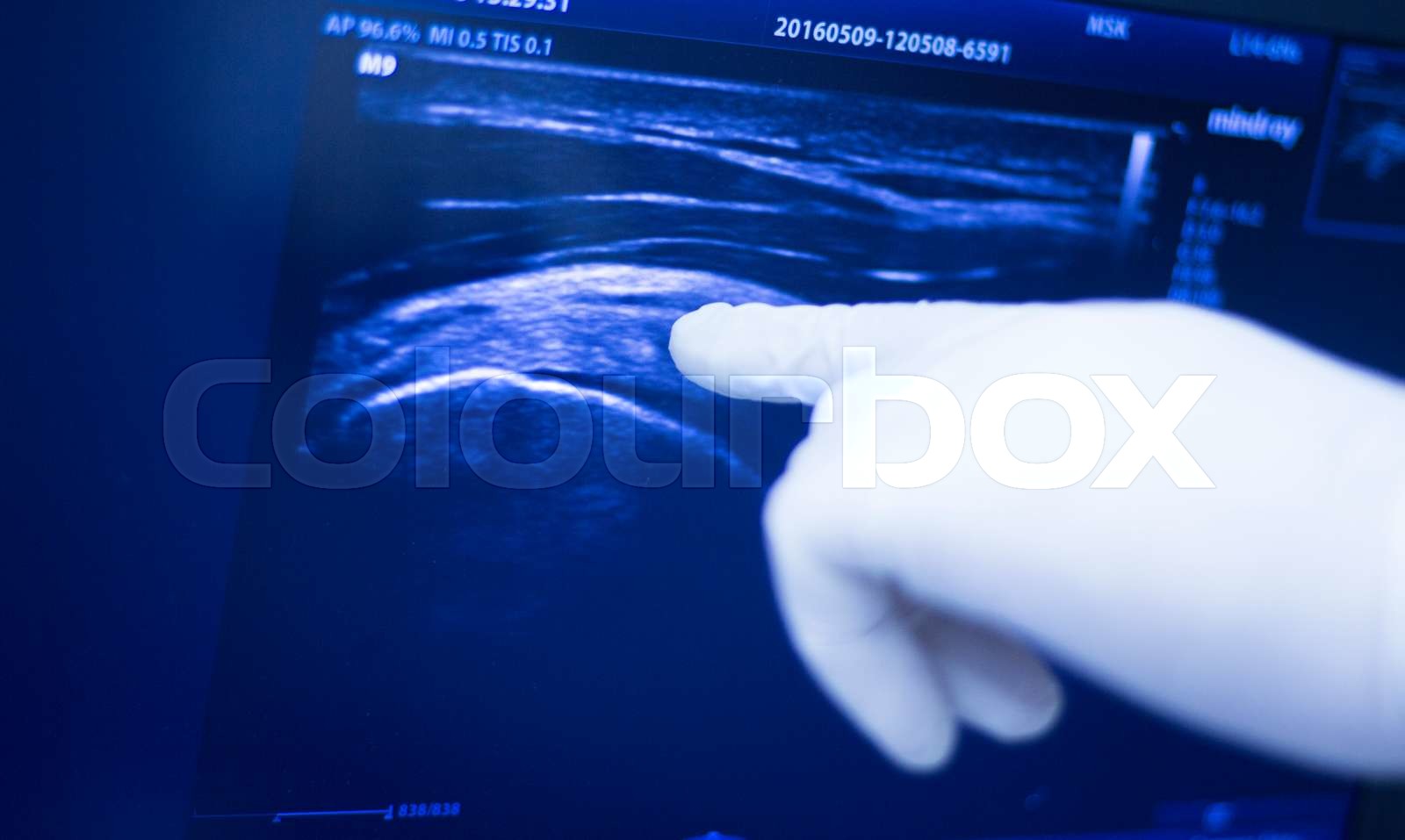 Ultrasound ecograph EPI ecography | Stock image | Colourbox