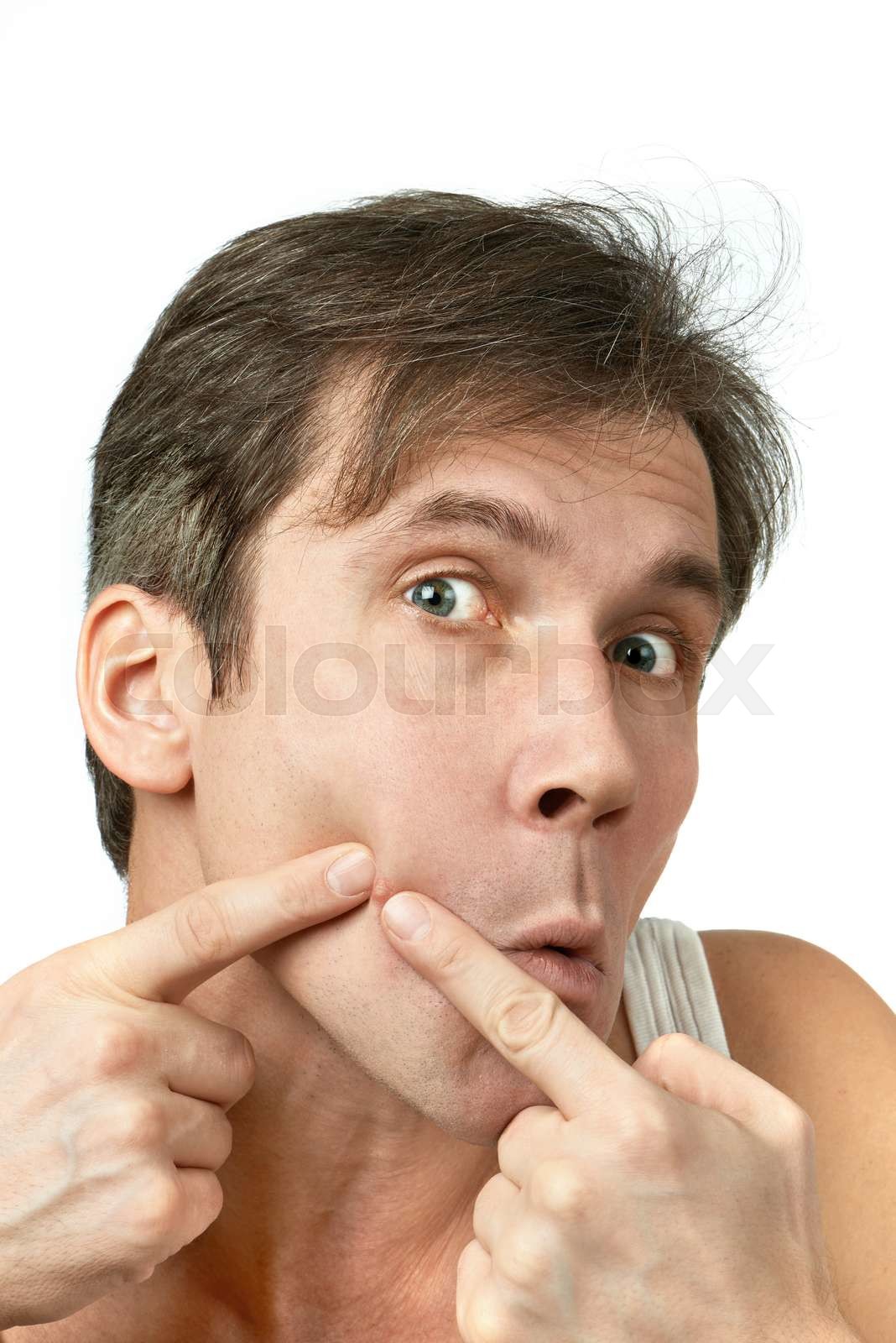 Men squeezing a pimple | Stock image | Colourbox