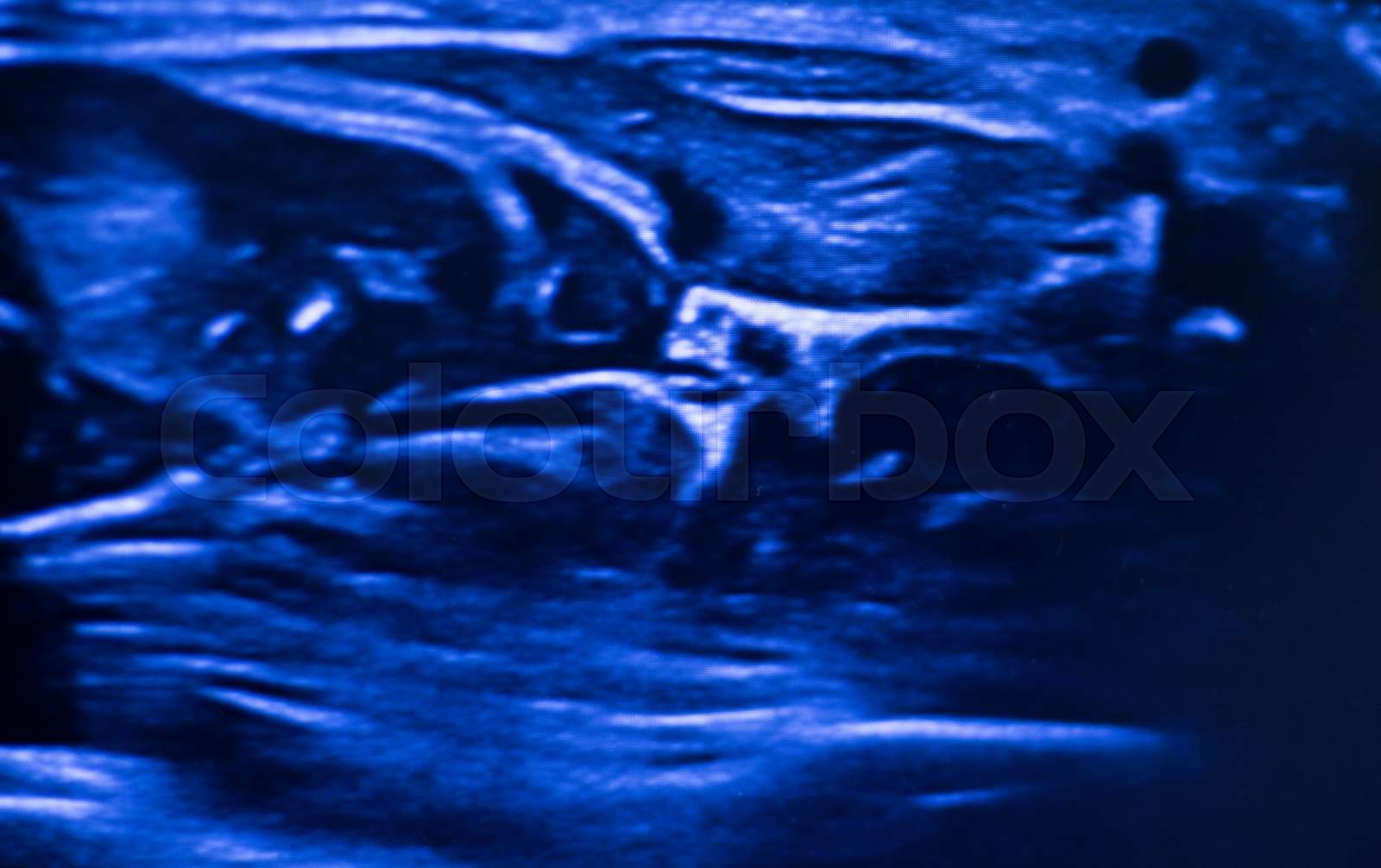 Ultrasound ecograph EPI ecography | Stock image | Colourbox