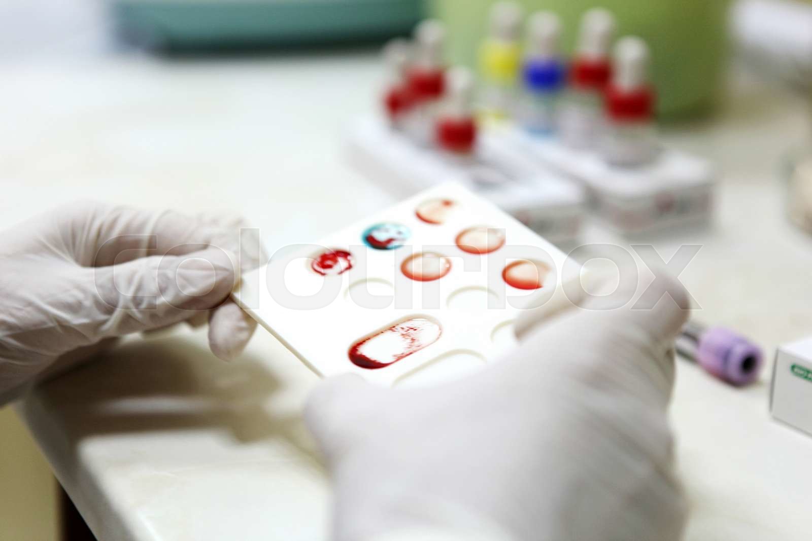 Blood test | Stock image | Colourbox