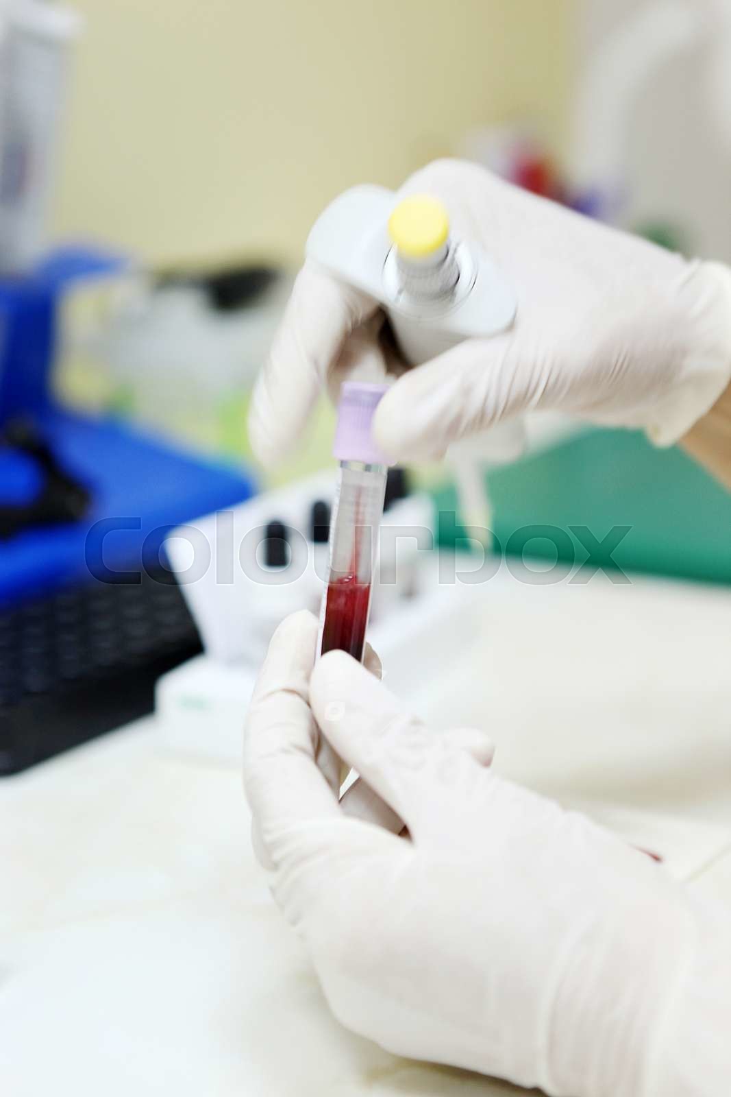 Blood test | Stock image | Colourbox