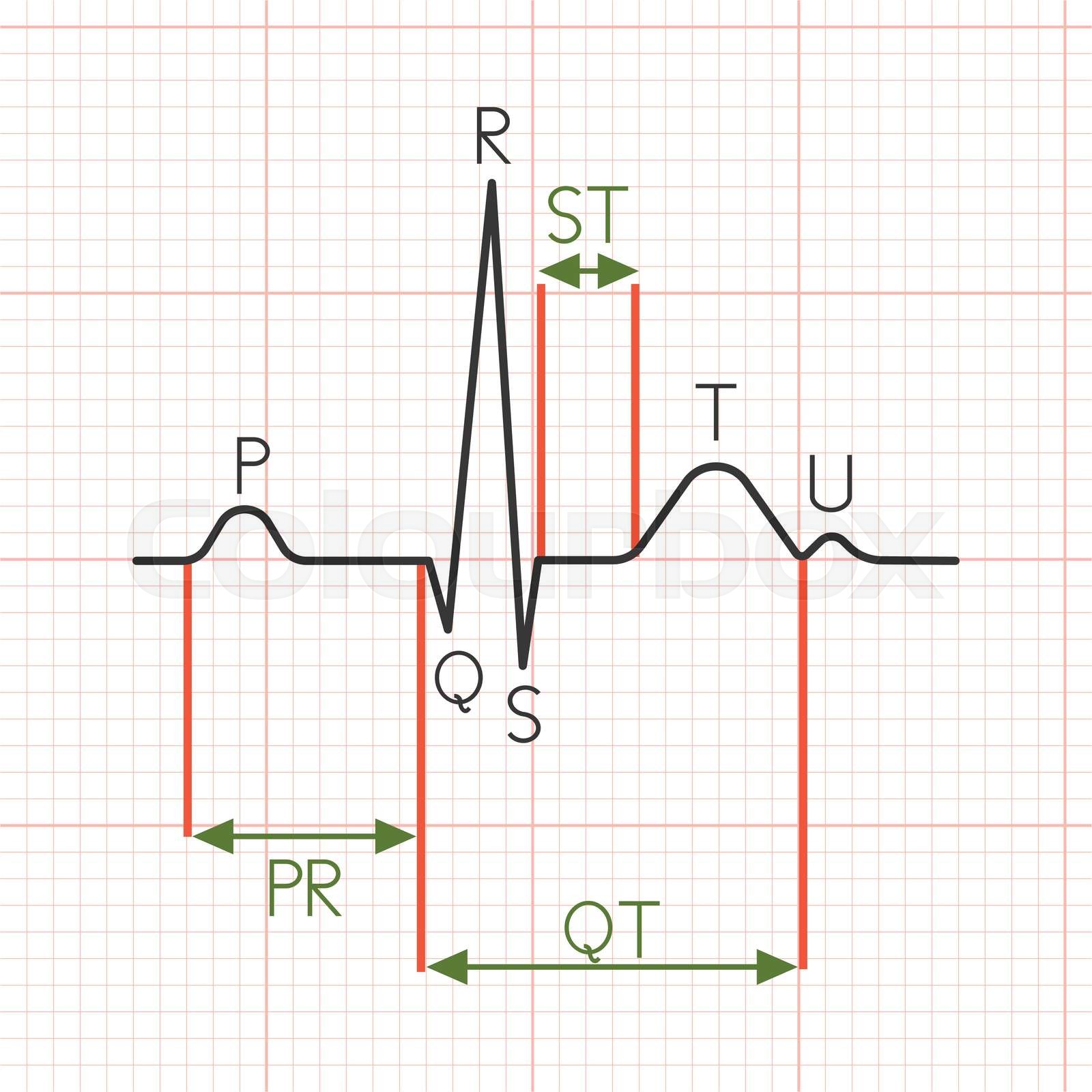 qt, ekg, medizinisch | Stock-Vektor | Colourbox