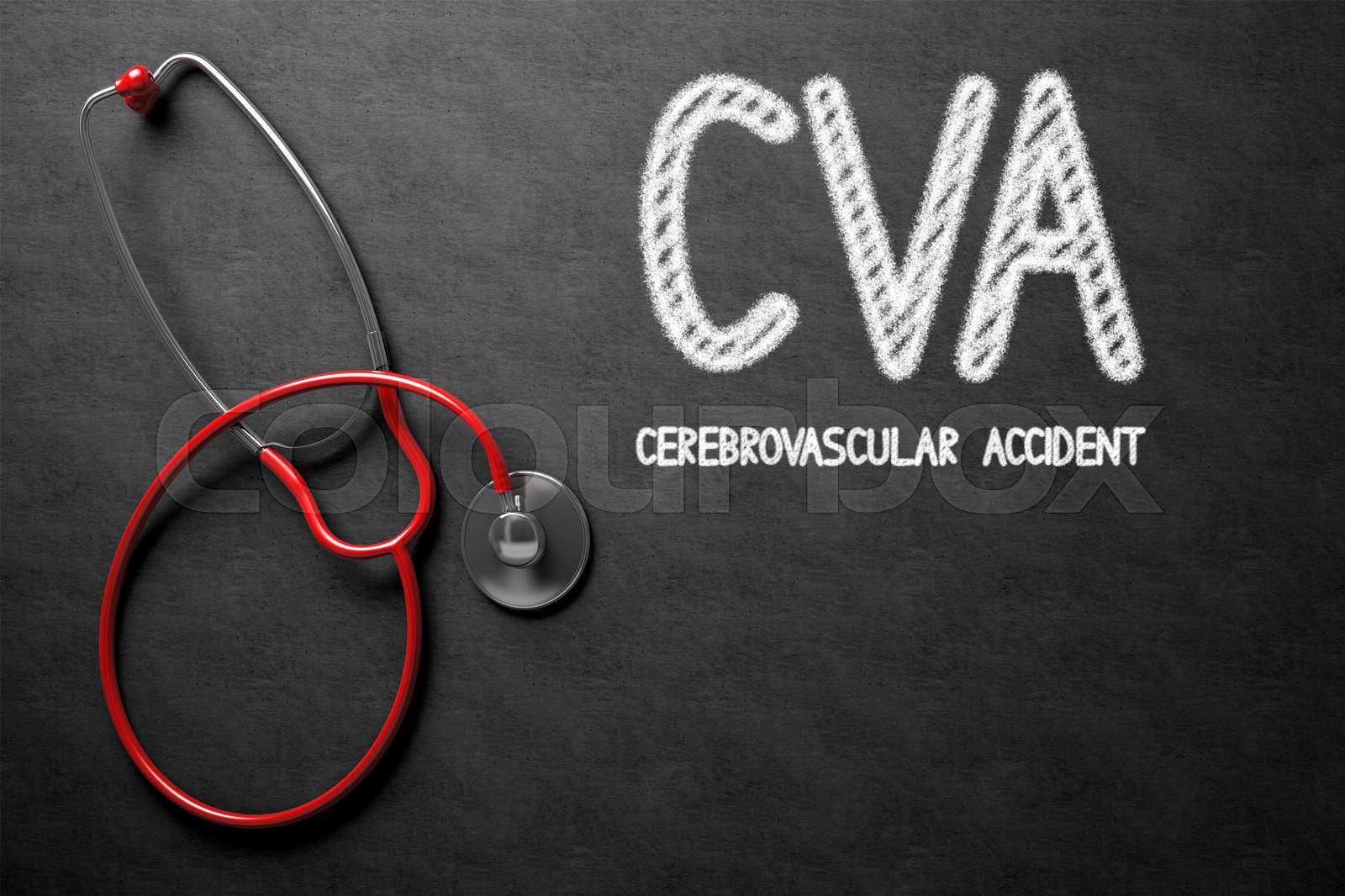 CVA Handwritten on Chalkboard. 3D Illustration. | Stock image | Colourbox