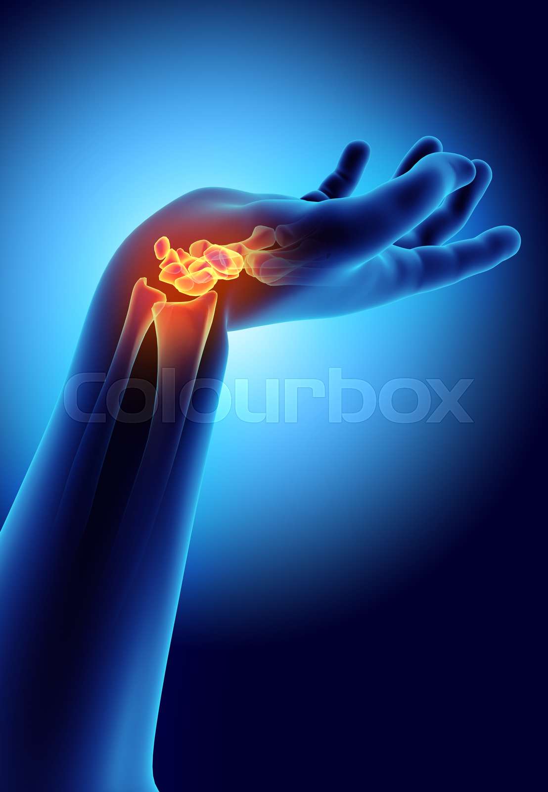 3D illustration of Carpal, medical concept. | Stock image | Colourbox