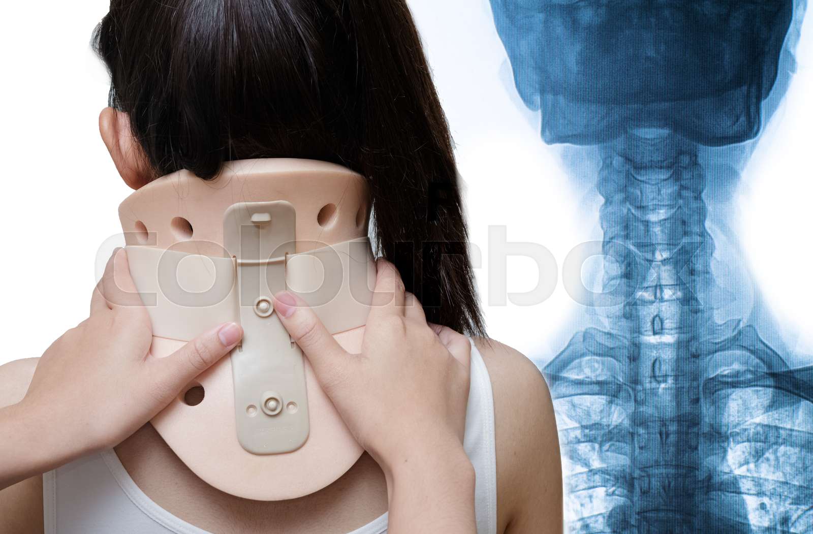 physical therapist checks a patient's spine with cervical spine x-ray ...