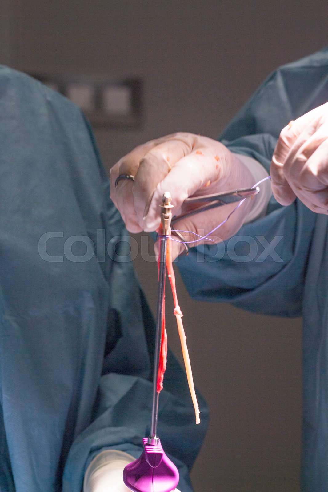 Knee tendon ligament surgery | Stock image | Colourbox