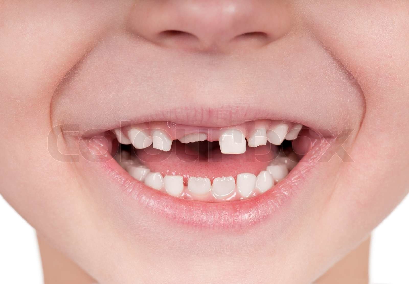 Happy little girl or boy toothless smile close-up | Stock image | Colourbox