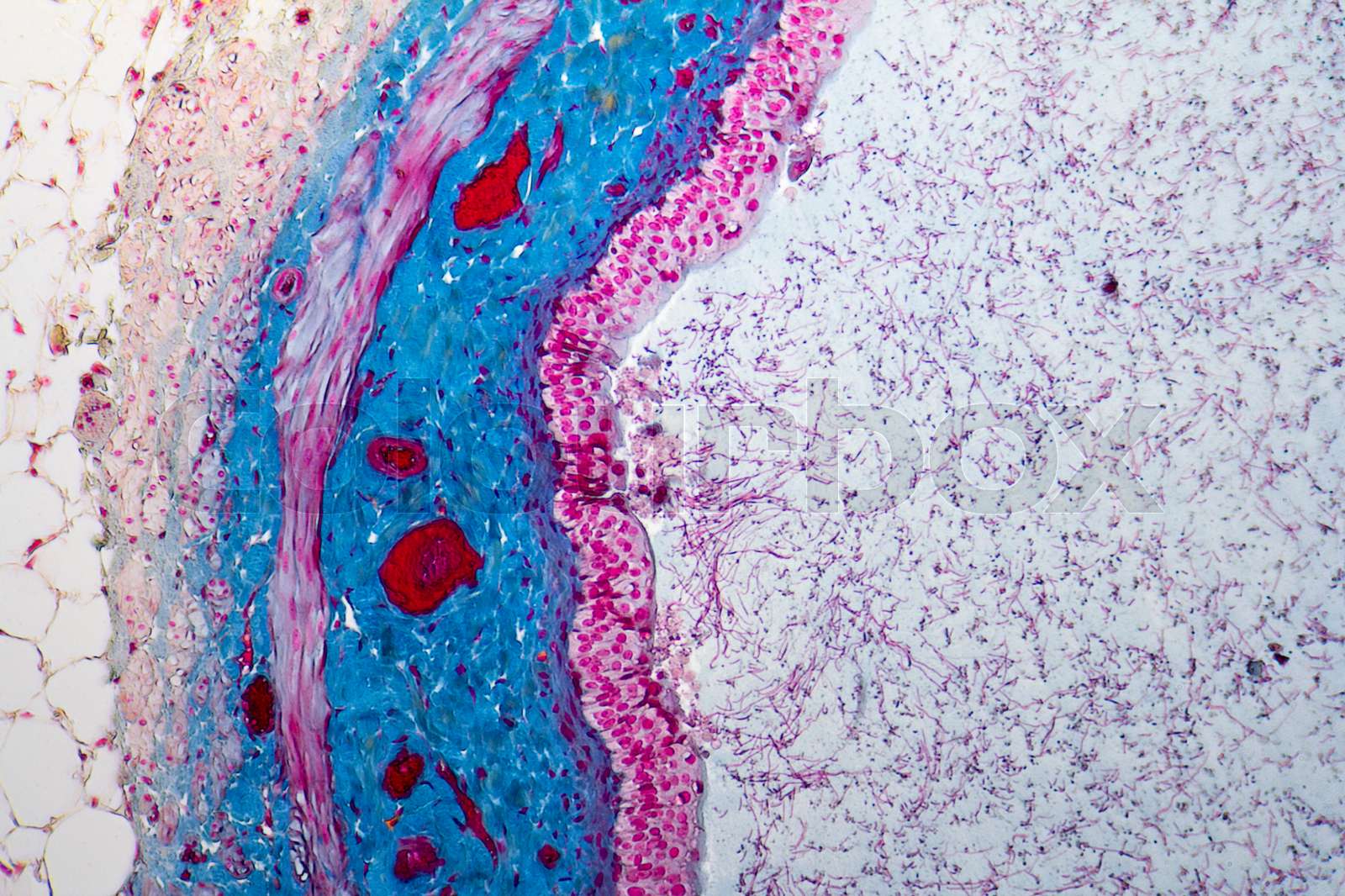 Urinary bladder micrograph | Stock image | Colourbox