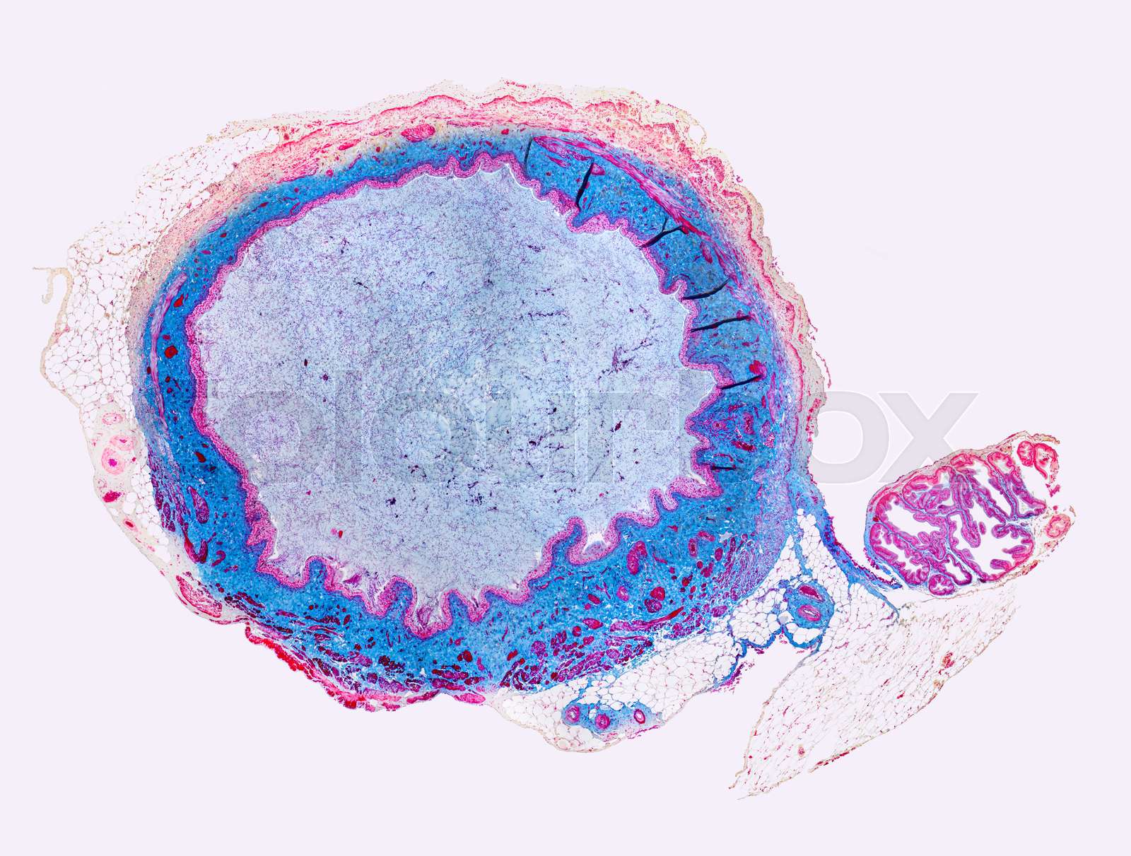Urinary bladder micrograph | Stock image | Colourbox