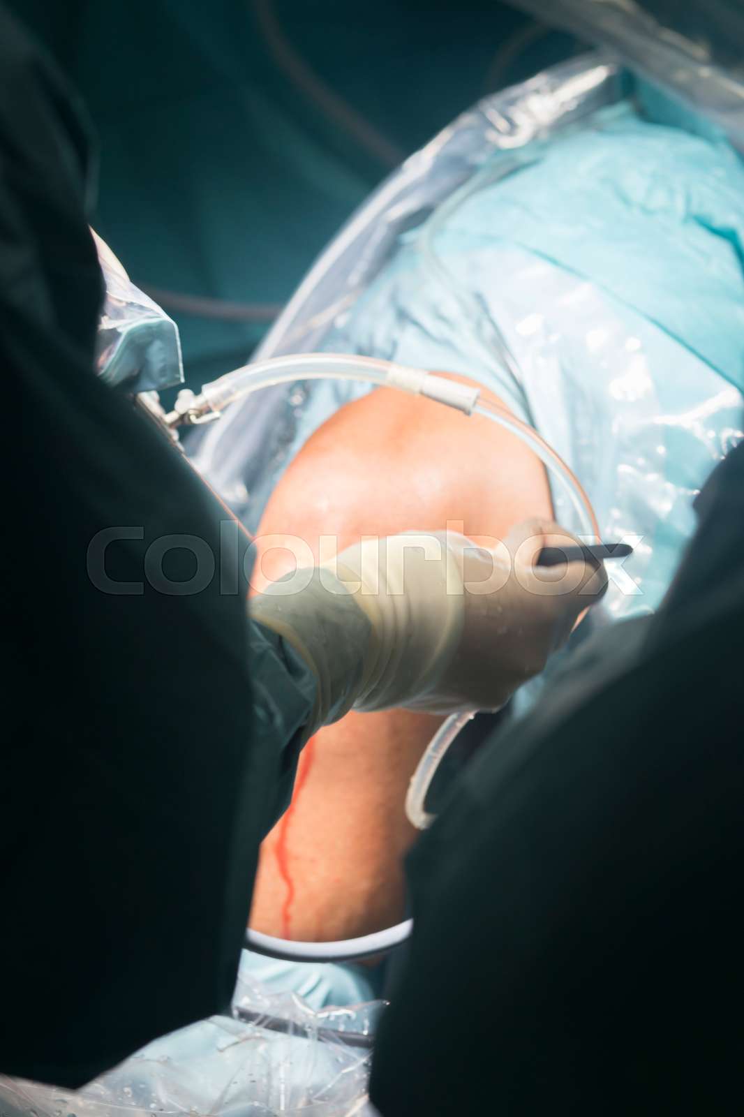 Knee surgery hospital operation | Stock image | Colourbox