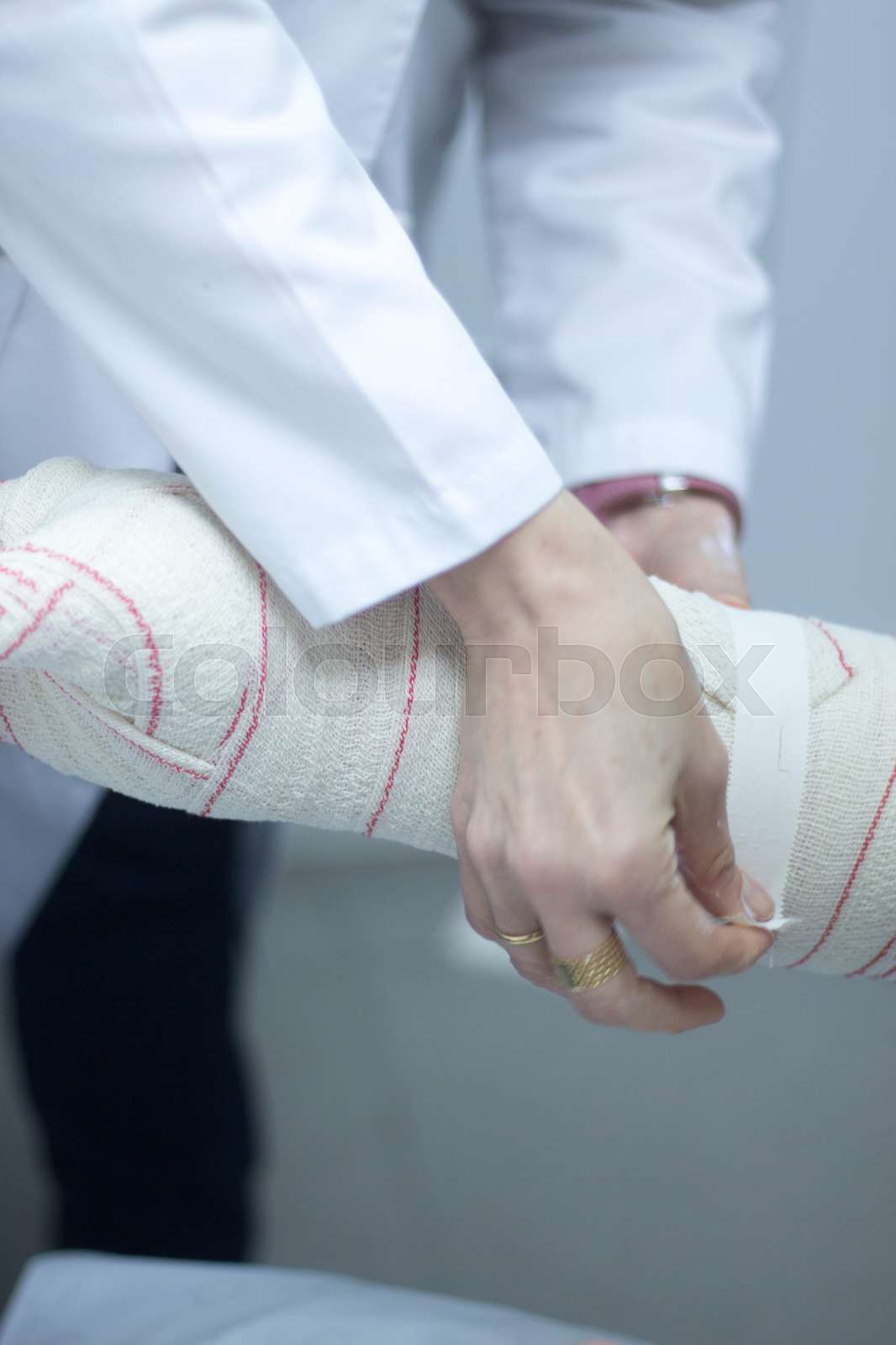 Doctor patient plaster cast | Stock image | Colourbox