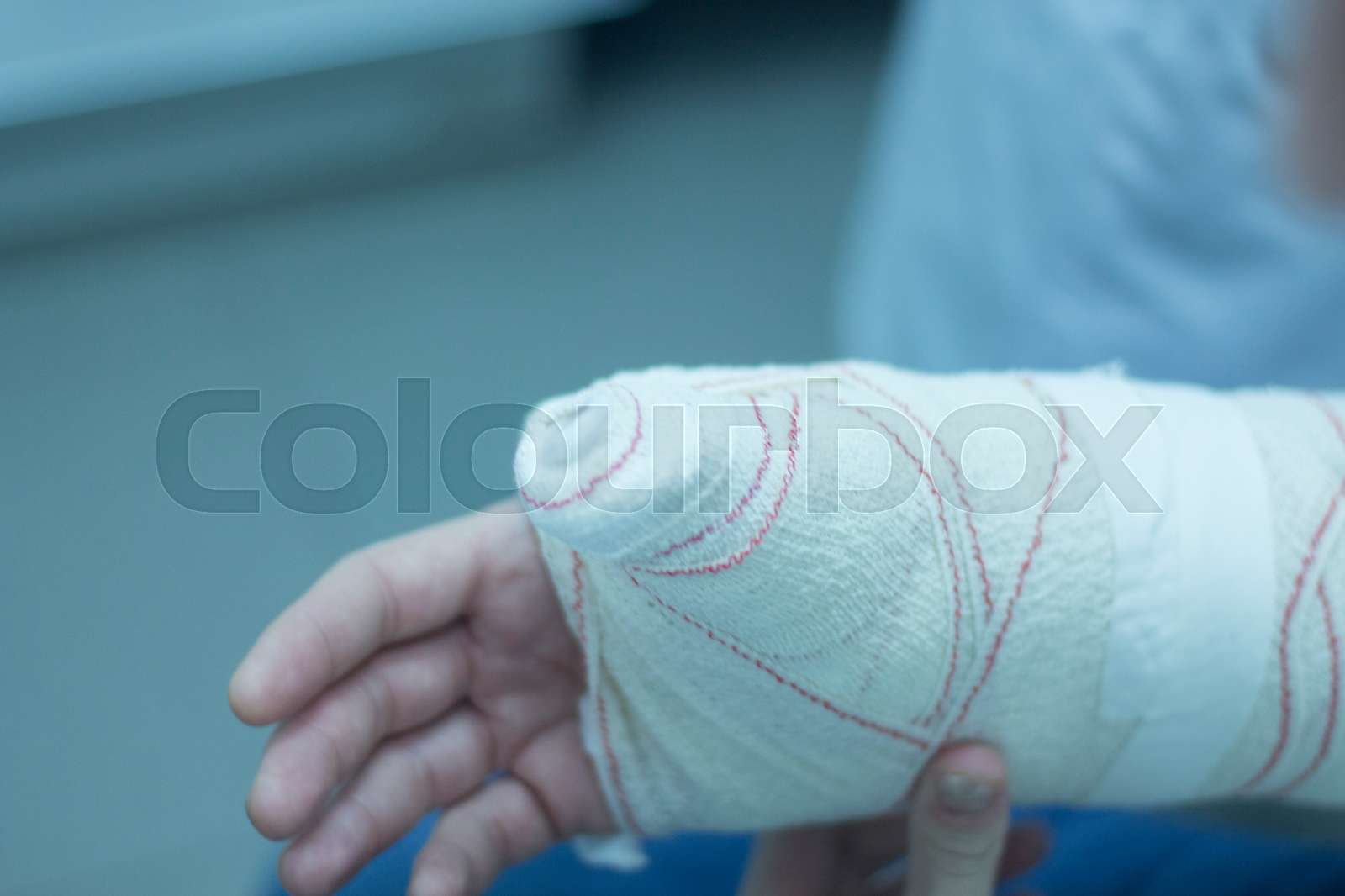 Doctor patient plaster cast | Stock image | Colourbox