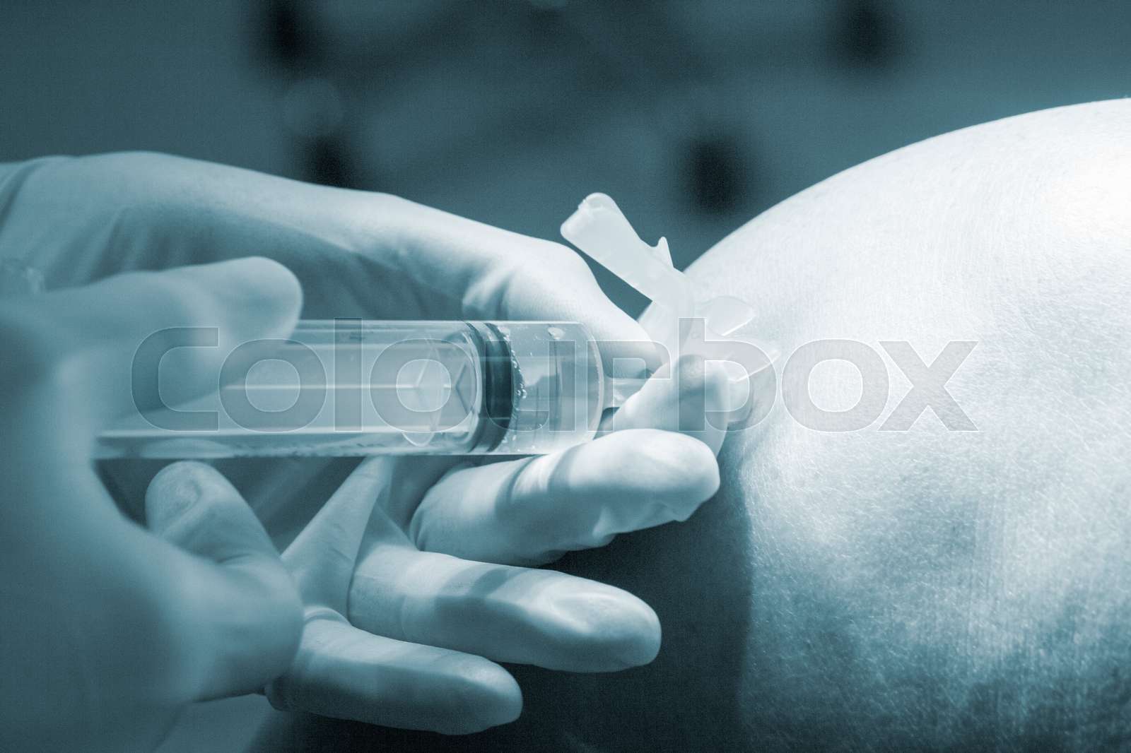 Anaesthetic injection in surgery | Stock image | Colourbox
