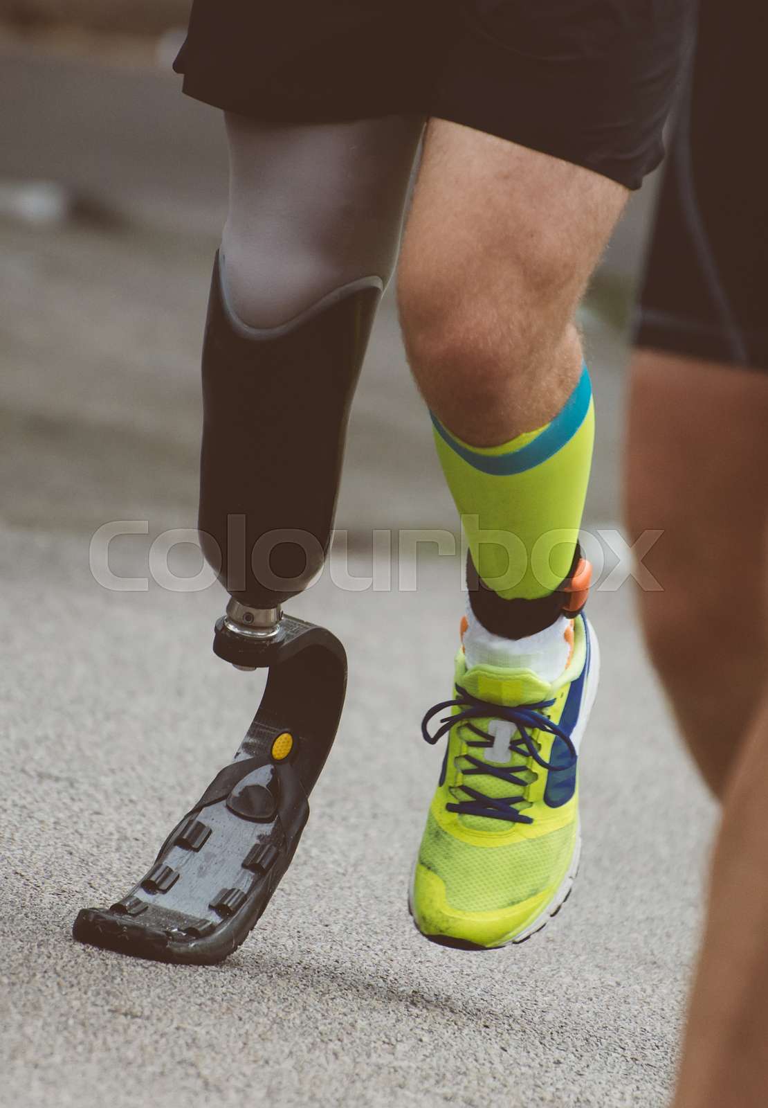 Man running with prosthetic leg on the street. | Stock image | Colourbox