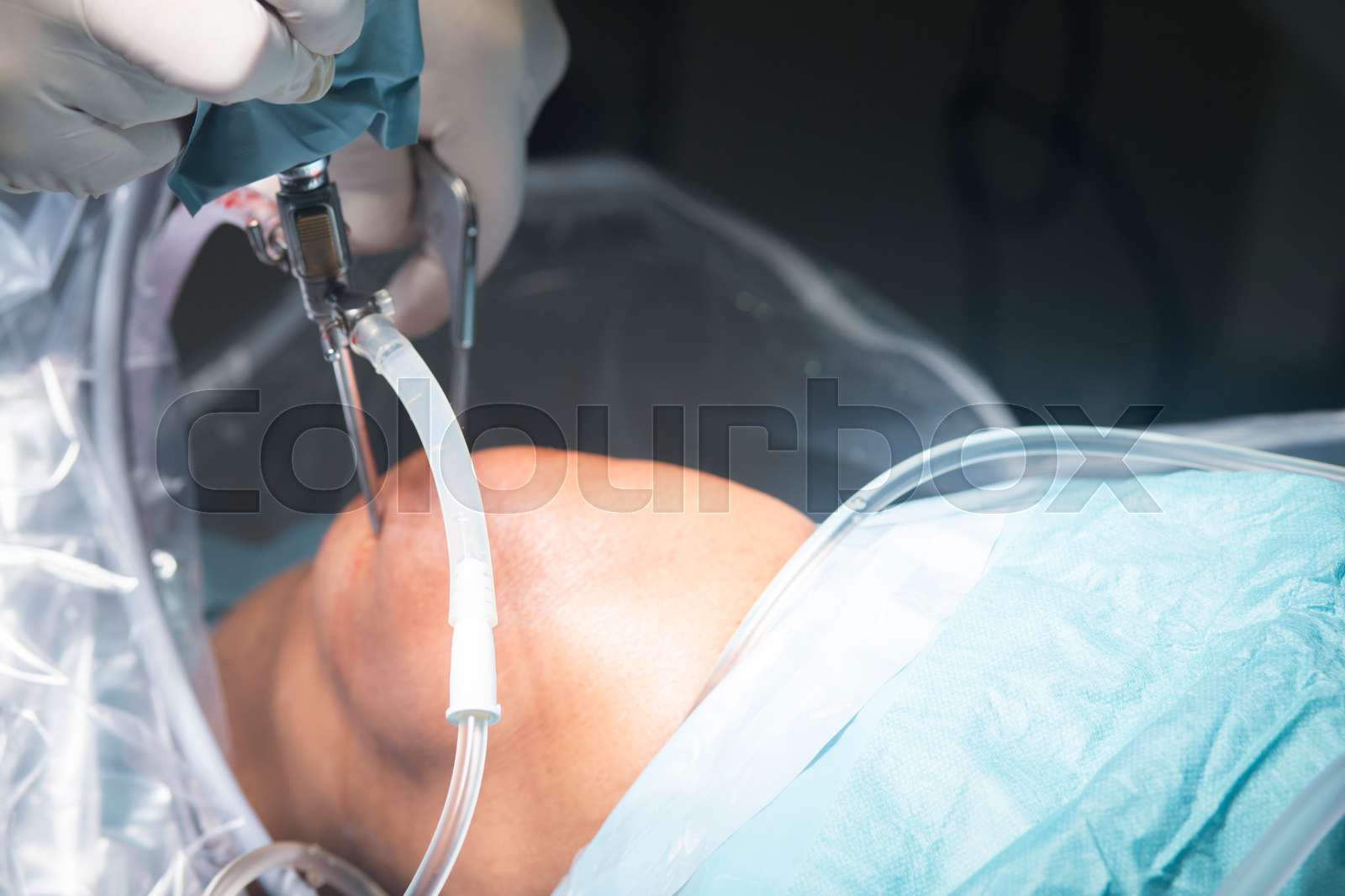 Knee surgery hospital operation | Stock image | Colourbox