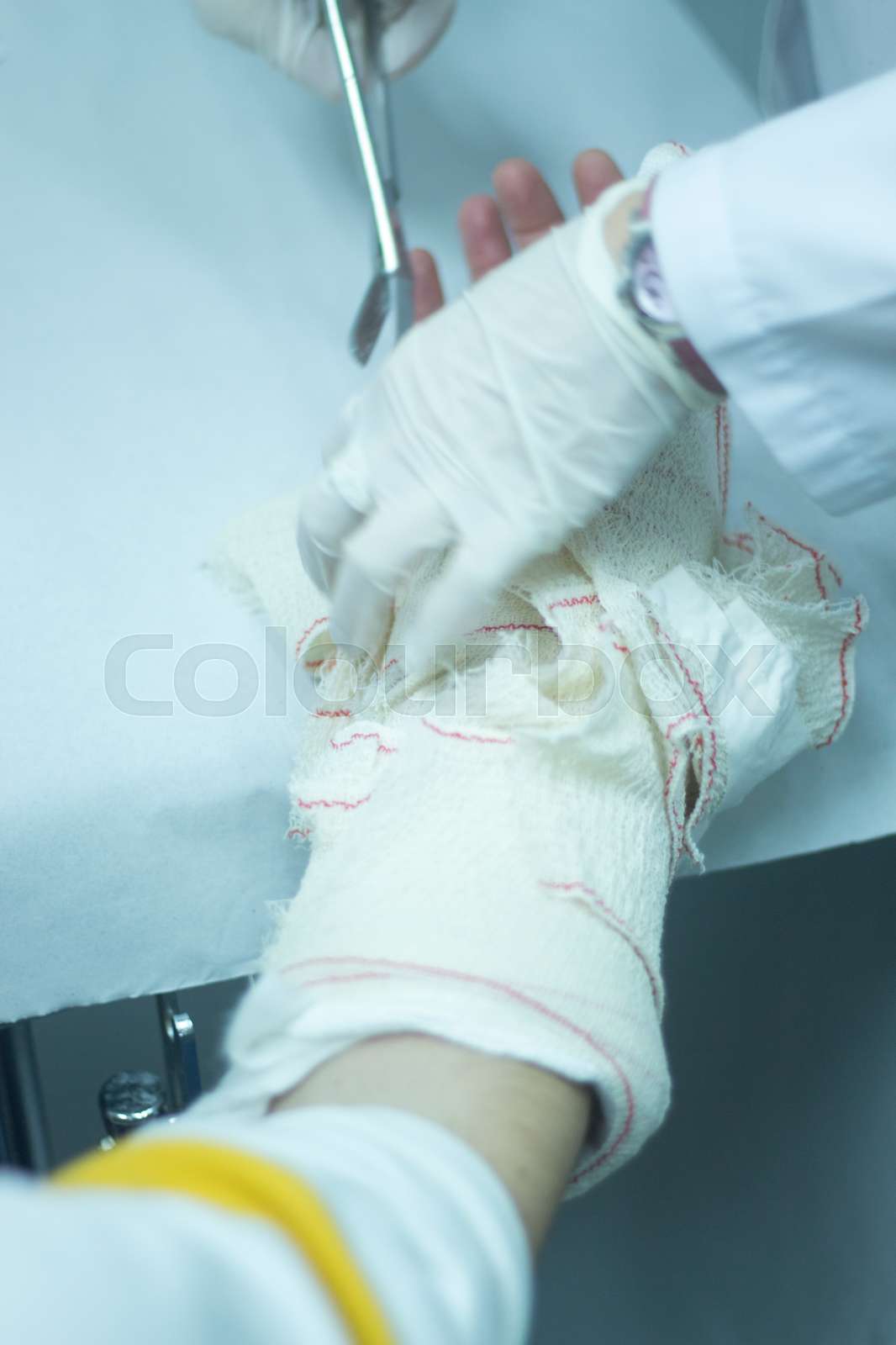 Doctor patient plaster cast | Stock image | Colourbox