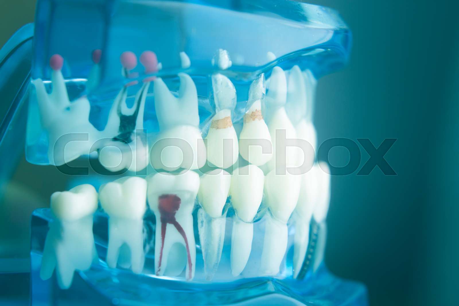 Dental teeth dentistry model | Stock image | Colourbox