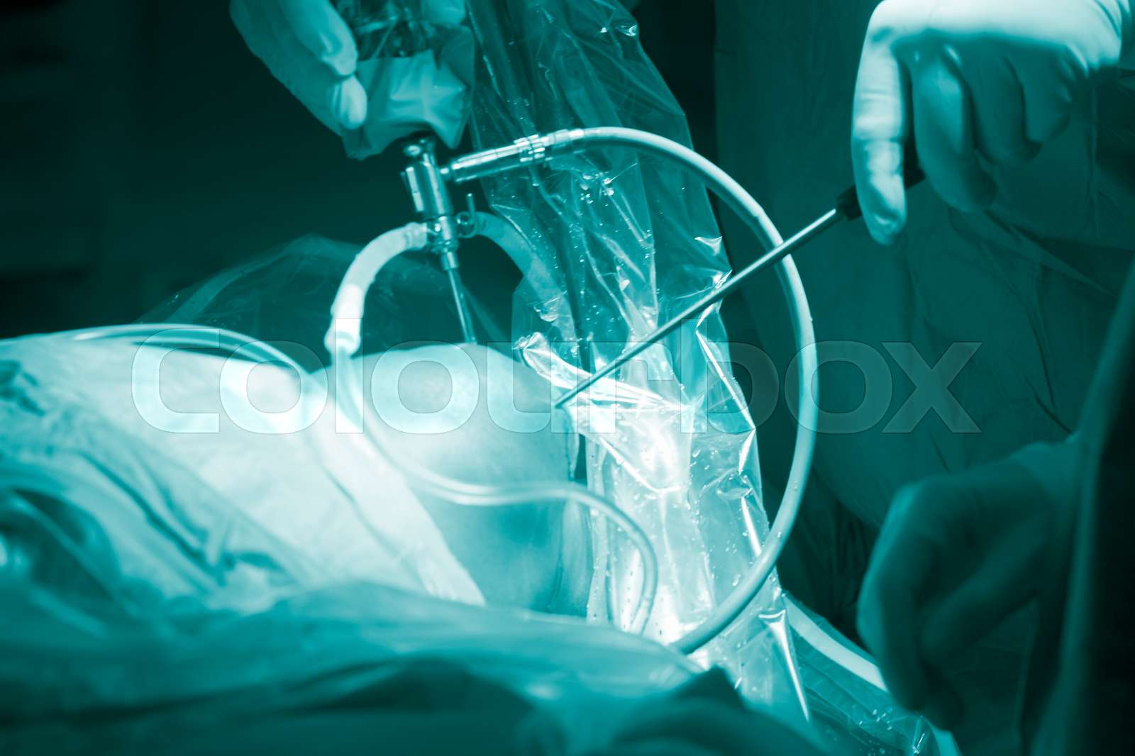 Knee surgery hospital operation | Stock image | Colourbox