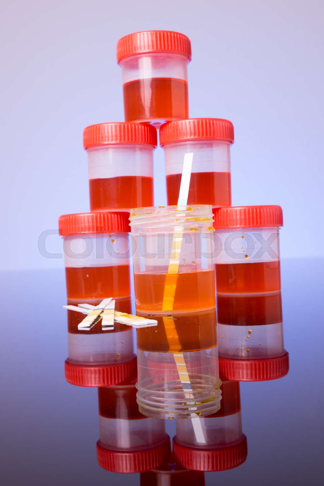 Pile of urine sample tube | Stock image | Colourbox