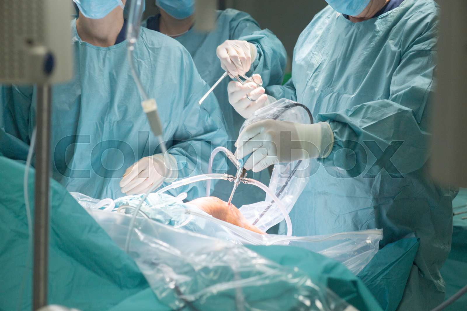 Knee surgery hospital operation | Stock image | Colourbox