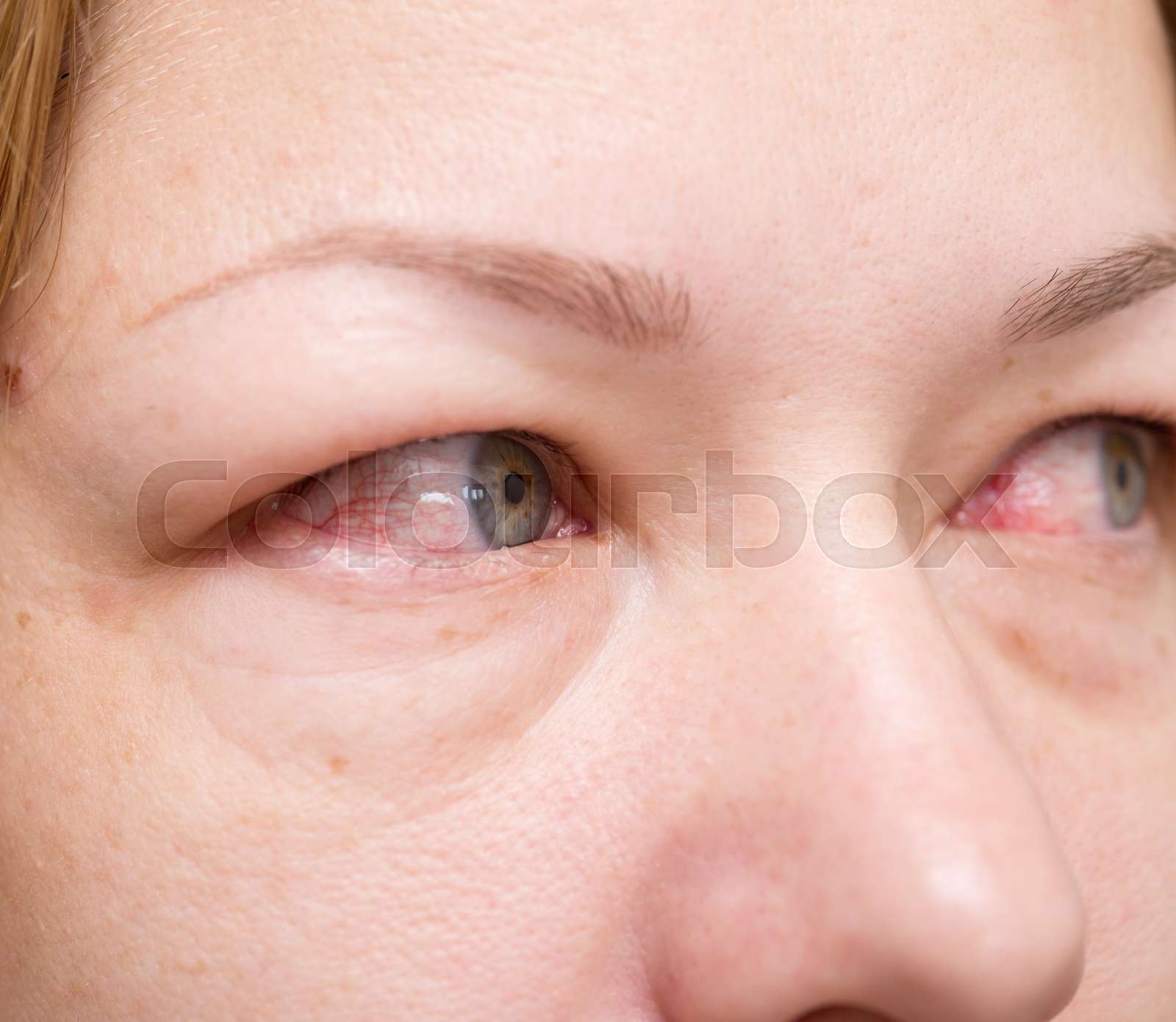 red eyes | Stock image | Colourbox