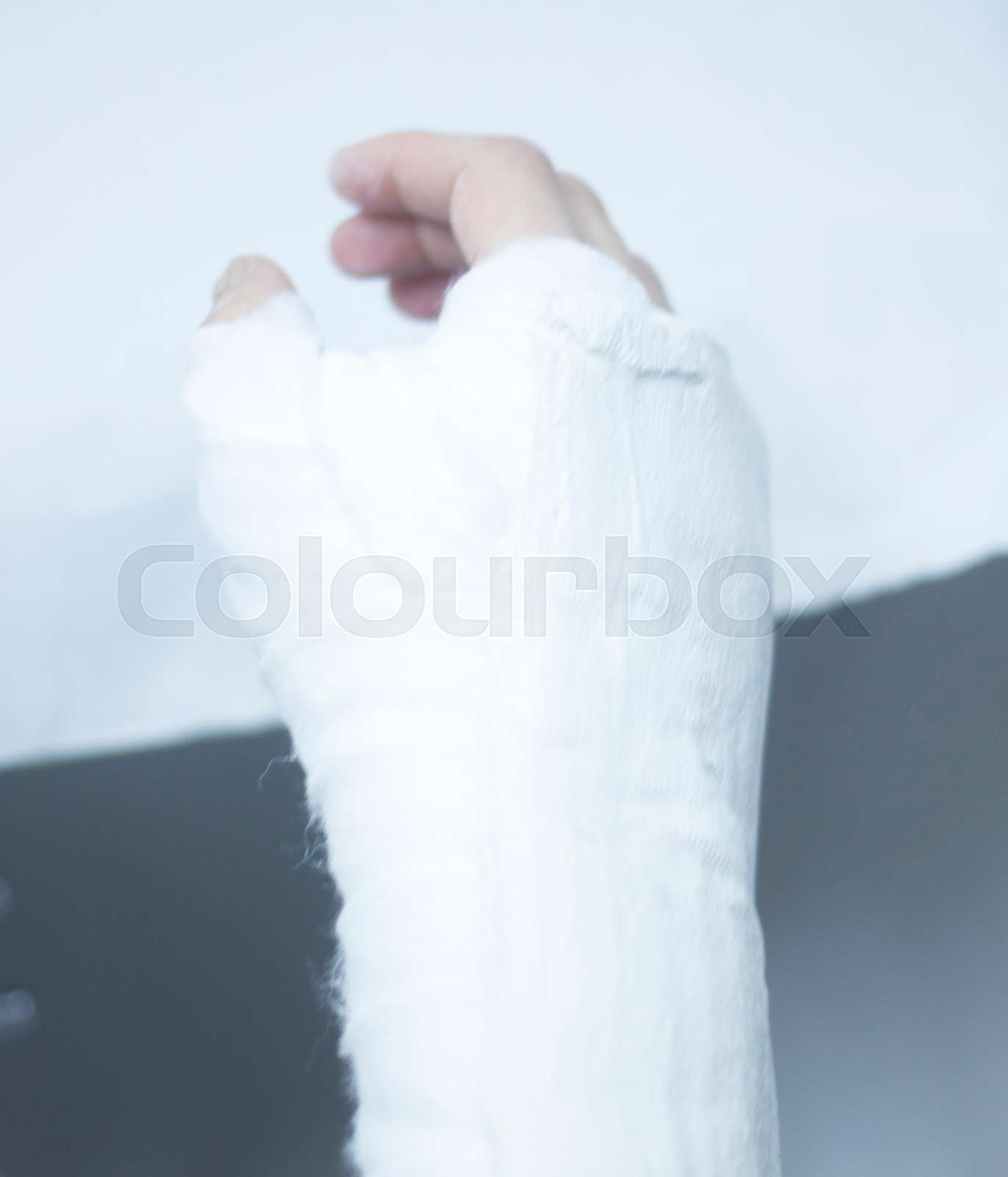 Doctor patient plaster cast | Stock image | Colourbox