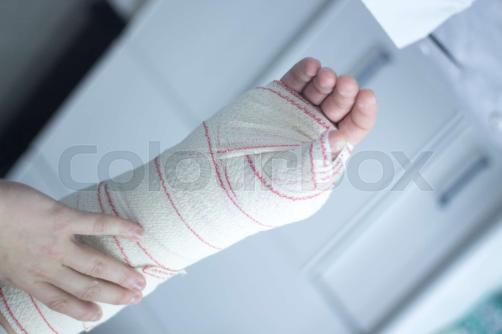 Doctor patient plaster cast | Stock image | Colourbox