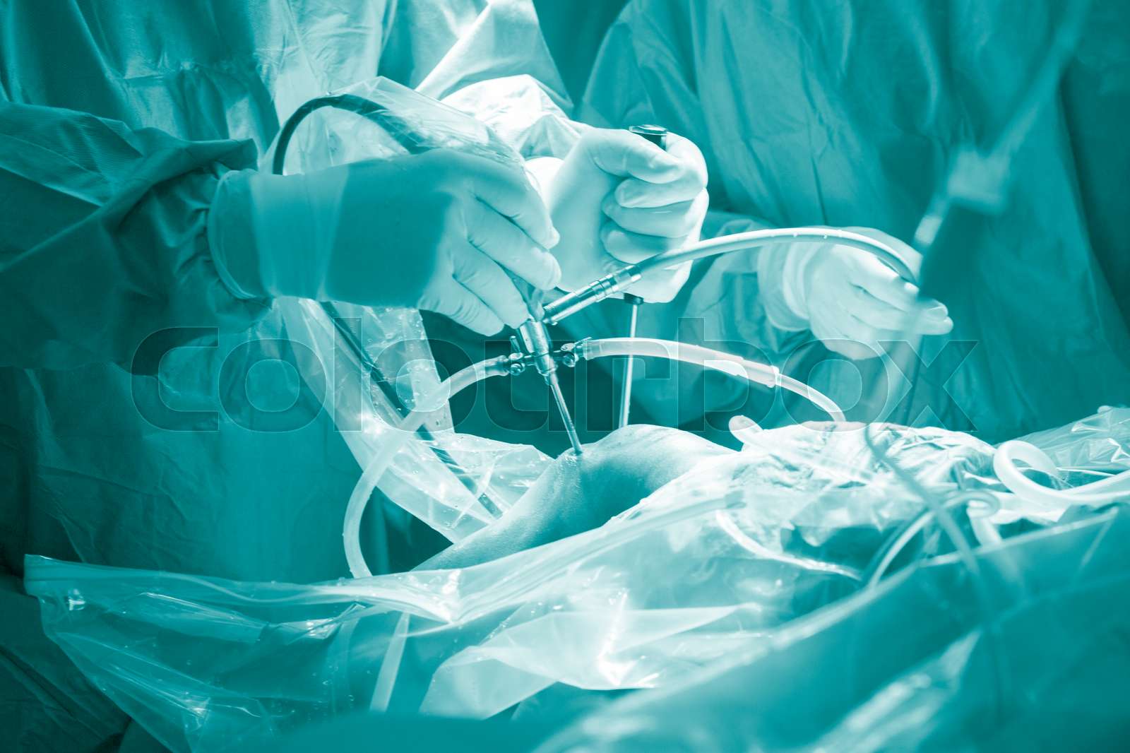 Knee surgery hospital operation | Stock image | Colourbox