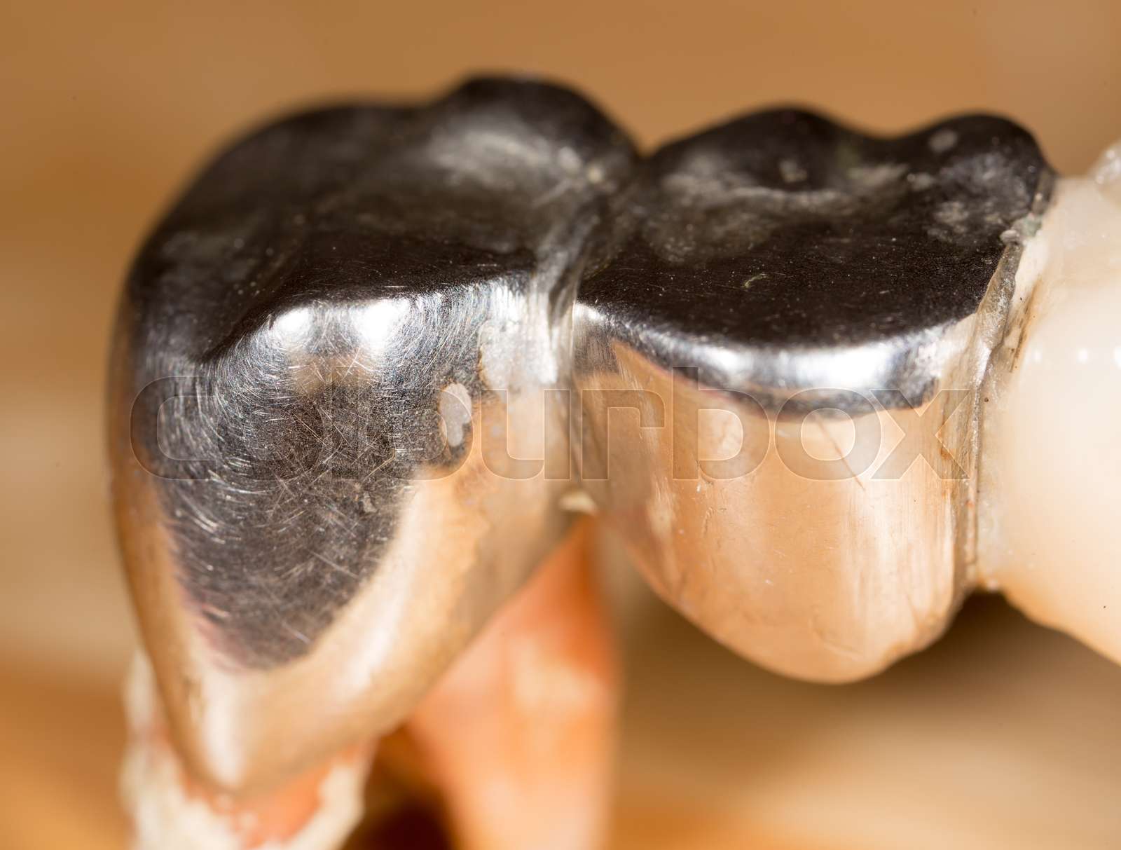 metal tooth. macro | Stock image | Colourbox