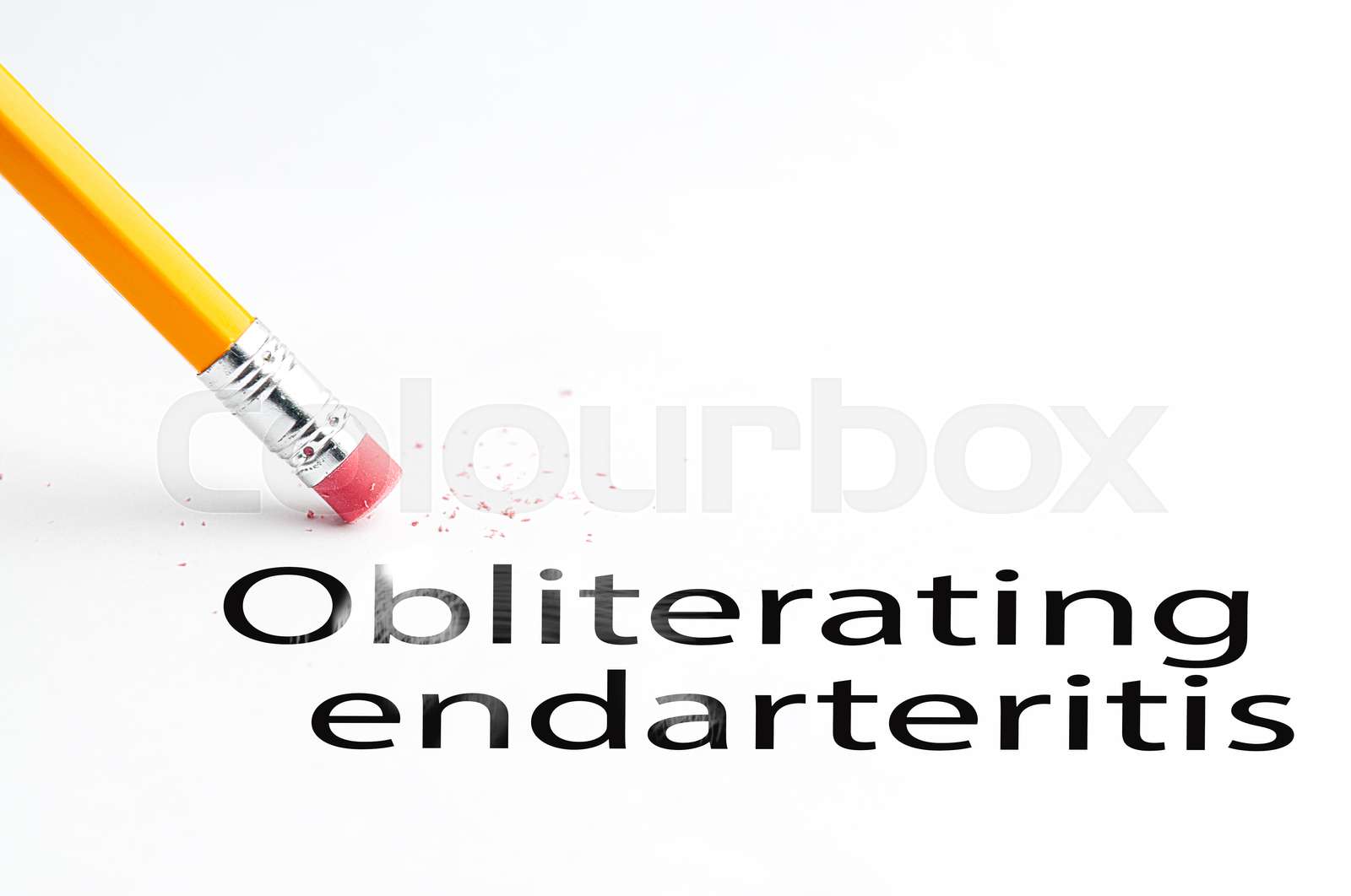 Pencil with eraser Obliterating endarteritis | Stock image | Colourbox